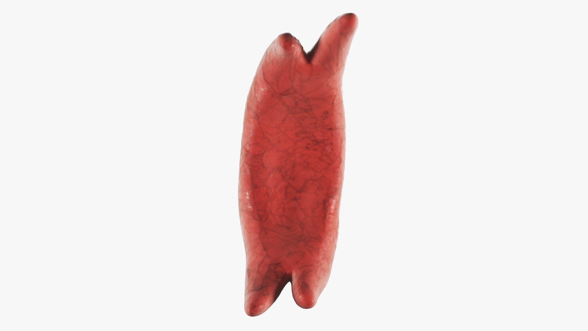 Sickle Cell Disease 3D Model - TurboSquid 1963320