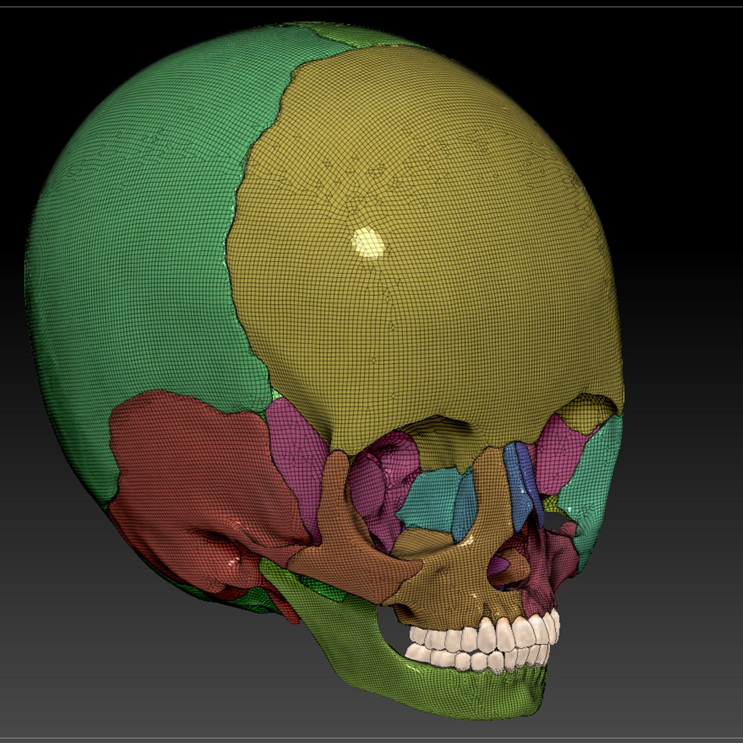 Obj Human Deformed Head Skull