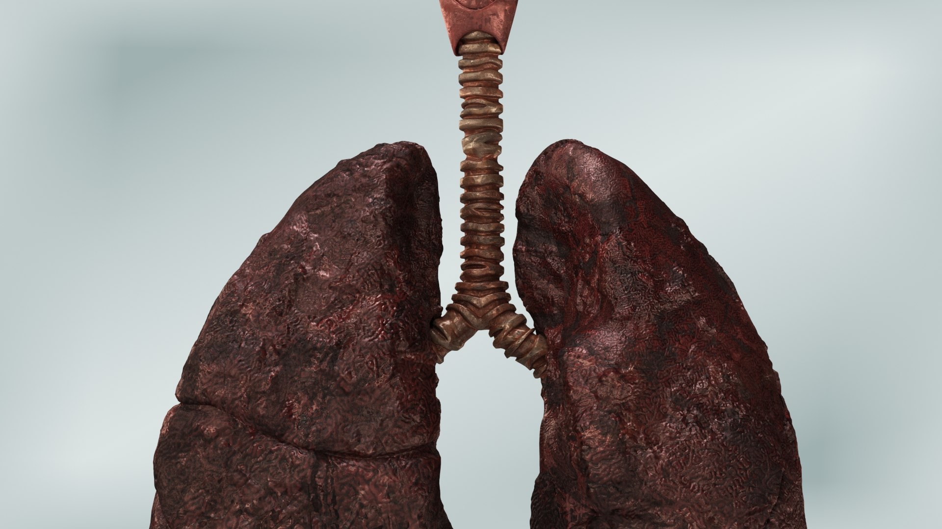 Smoker S Lungs 3D Model - TurboSquid 1662649