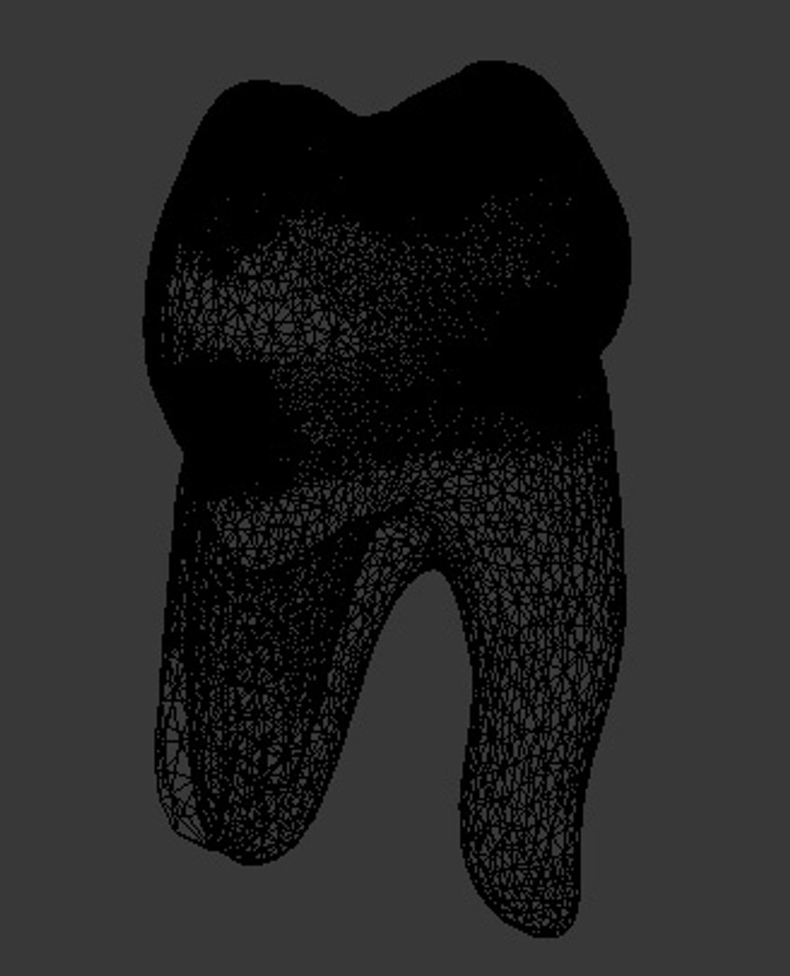 Molar Tooth 3d Model