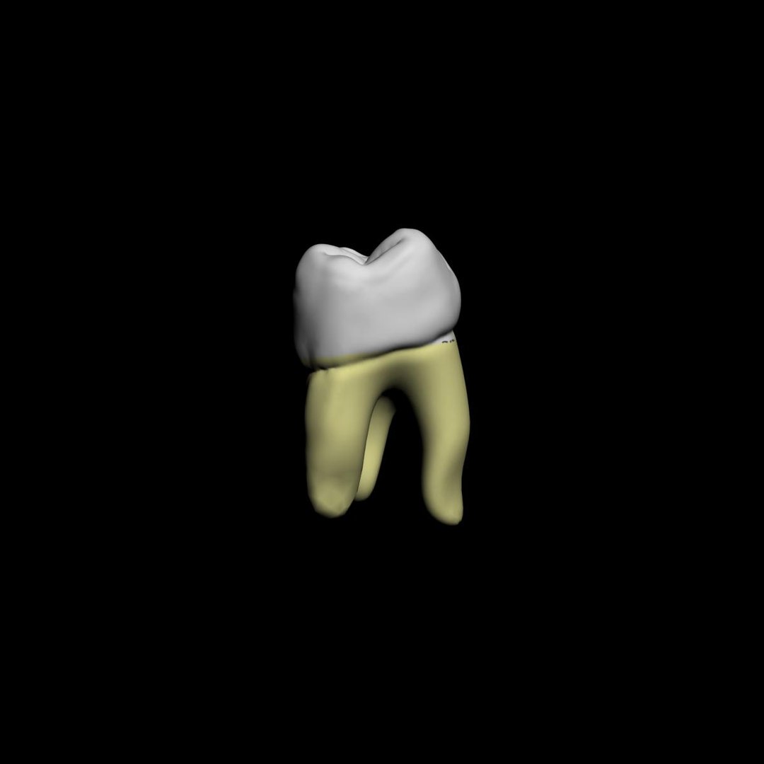 Molar Tooth 3d Model