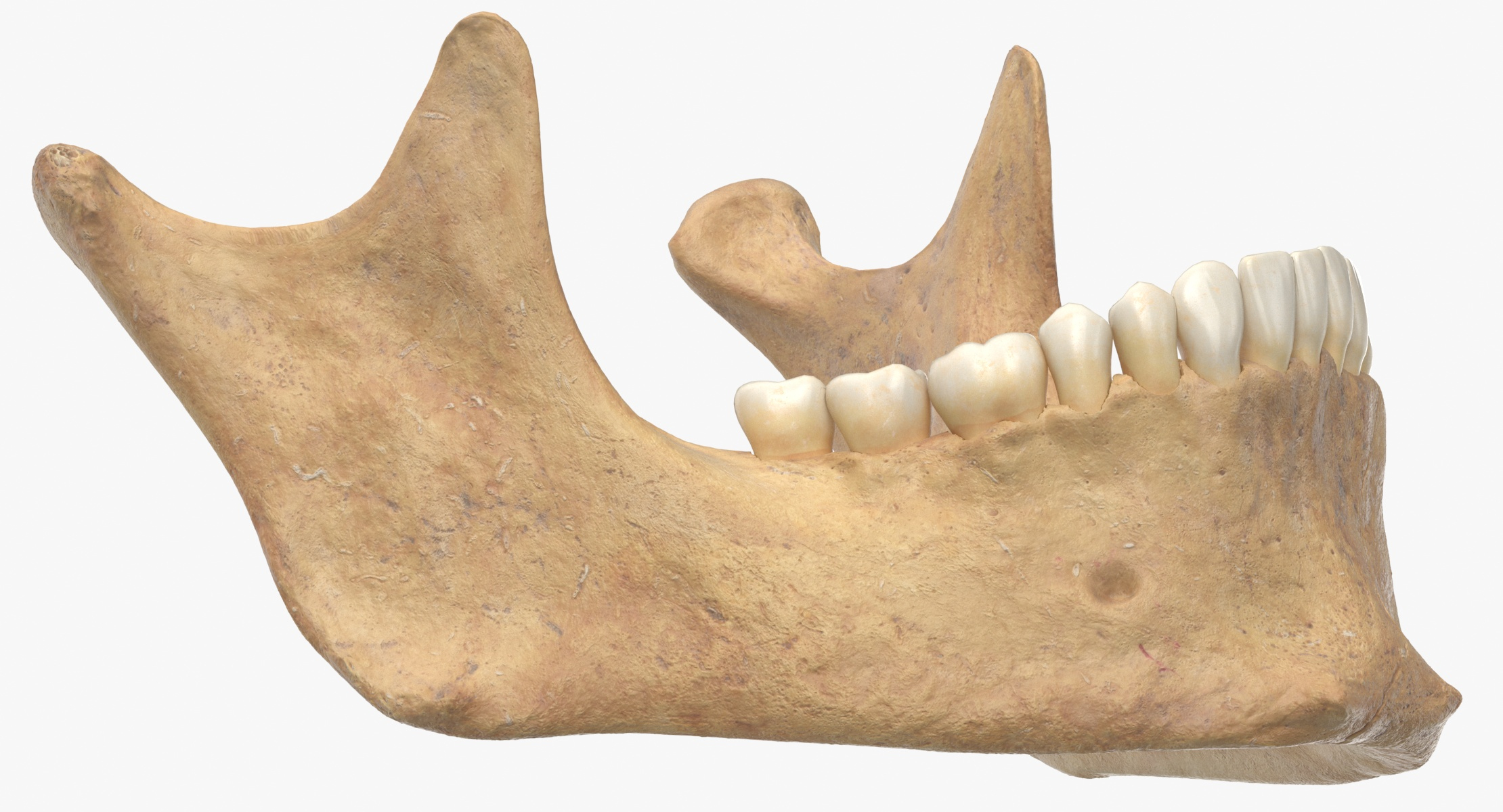 Human Male Jawbones With And Without Damages Collection White and ...