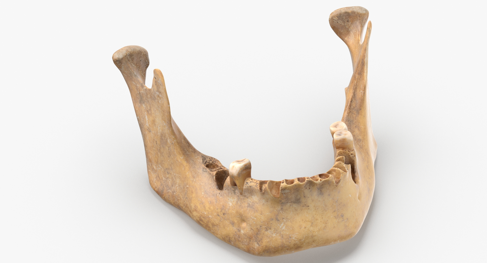 Human Male Jawbones With And Without Damages Collection White and ...