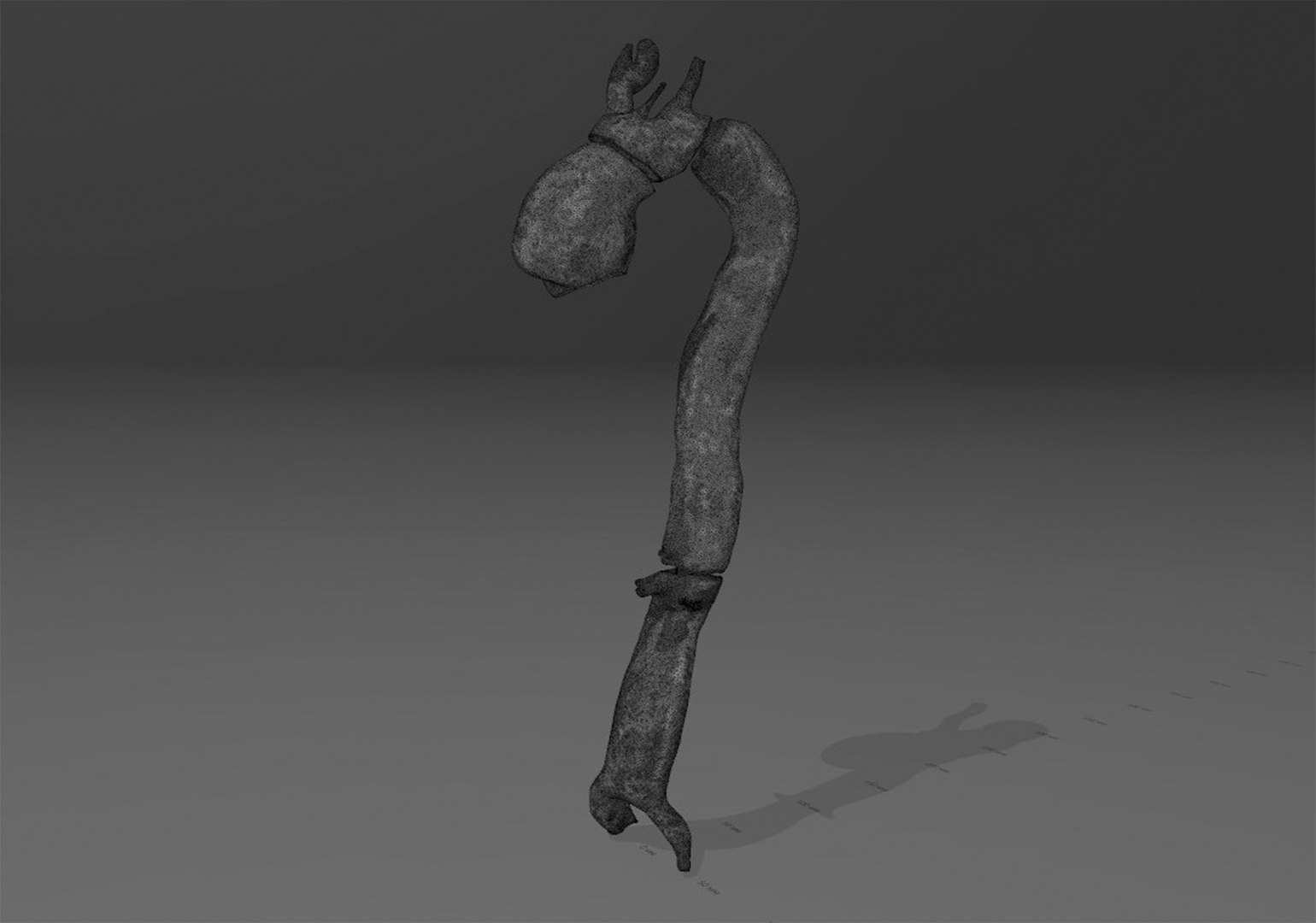 Real aortic dissection 3D model - TurboSquid 2147080