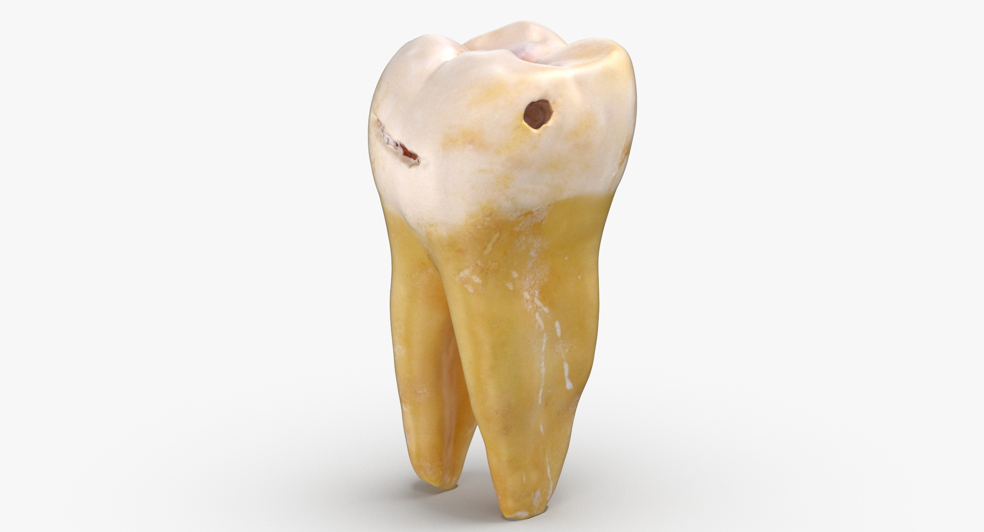 Molar Lower Jaw Left Model - TurboSquid 1518784