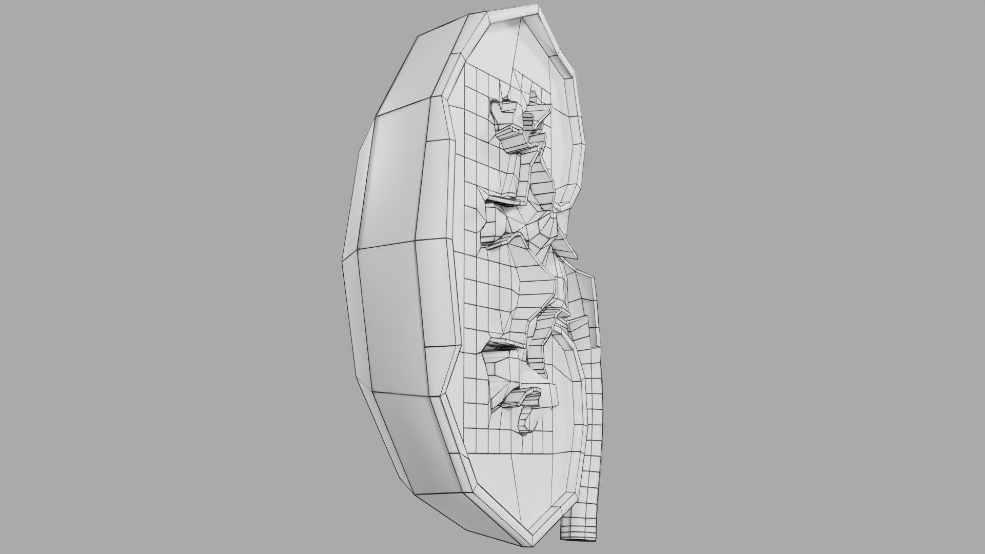 Kidney Stone Nephrolithiasis Staghorn Calculus 3D Model - TurboSquid ...