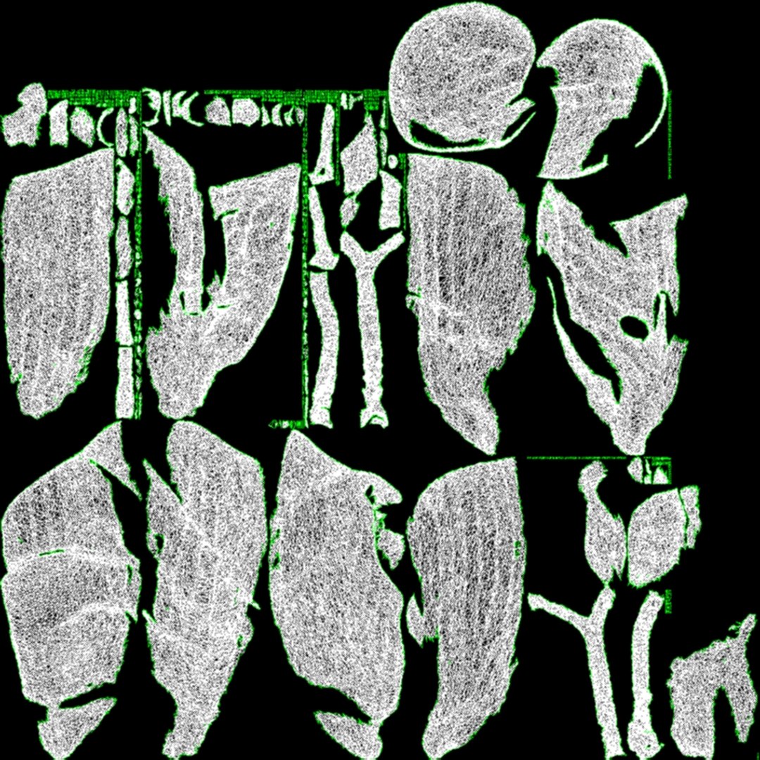 High-Detail Human Lung Anatomy 3D Model 3D Model - TurboSquid 2319101