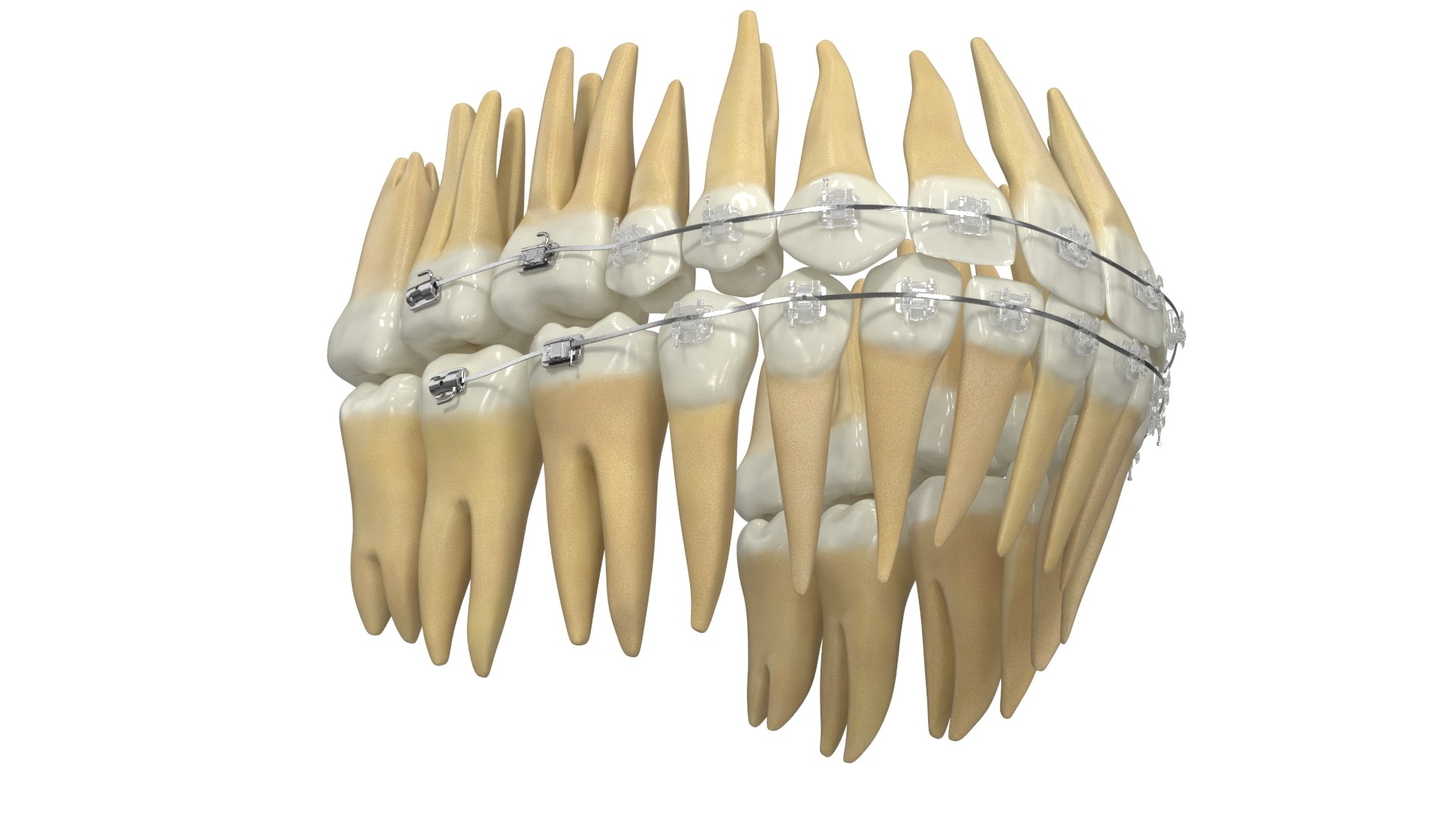 3D Human Teeth With Self Ligating Transparent Dental Braces V01 model ...