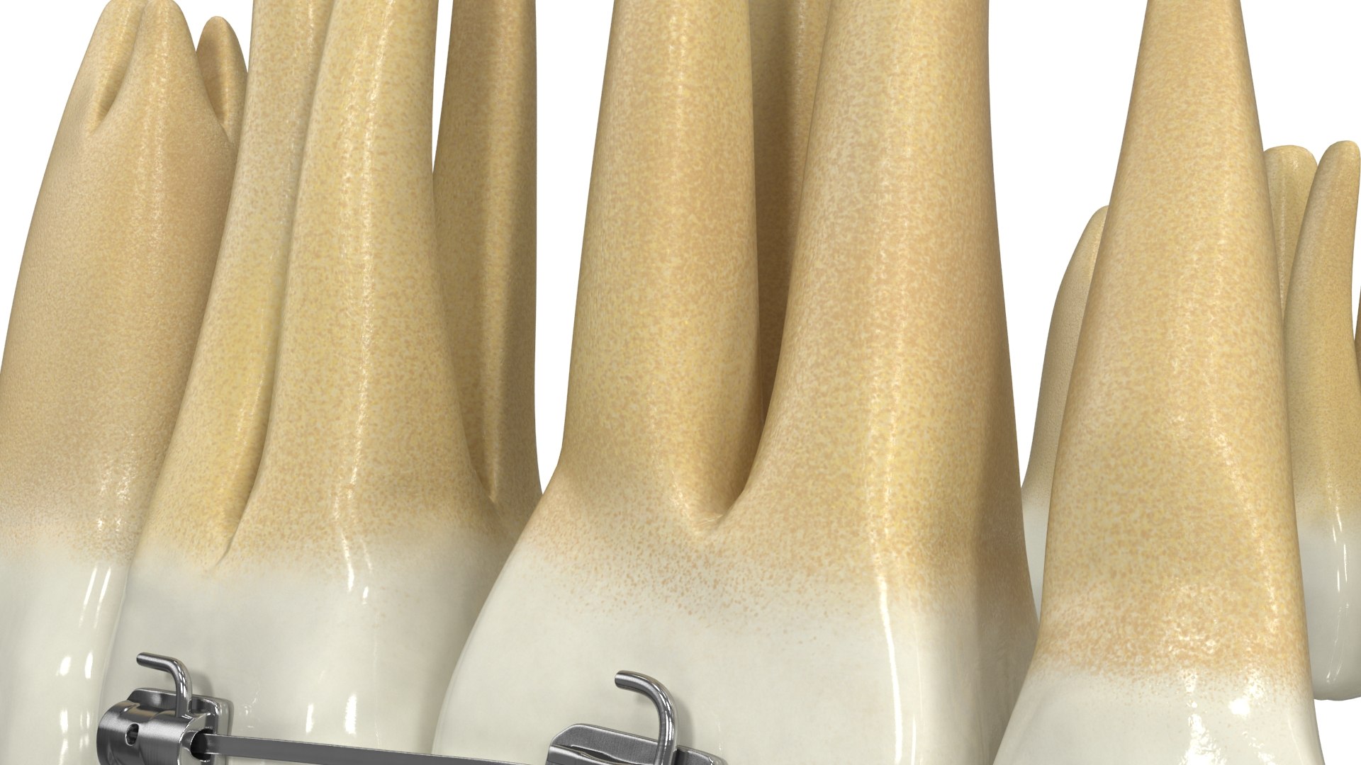 3D Human Teeth With Self Ligating Transparent Dental Braces V01 model ...