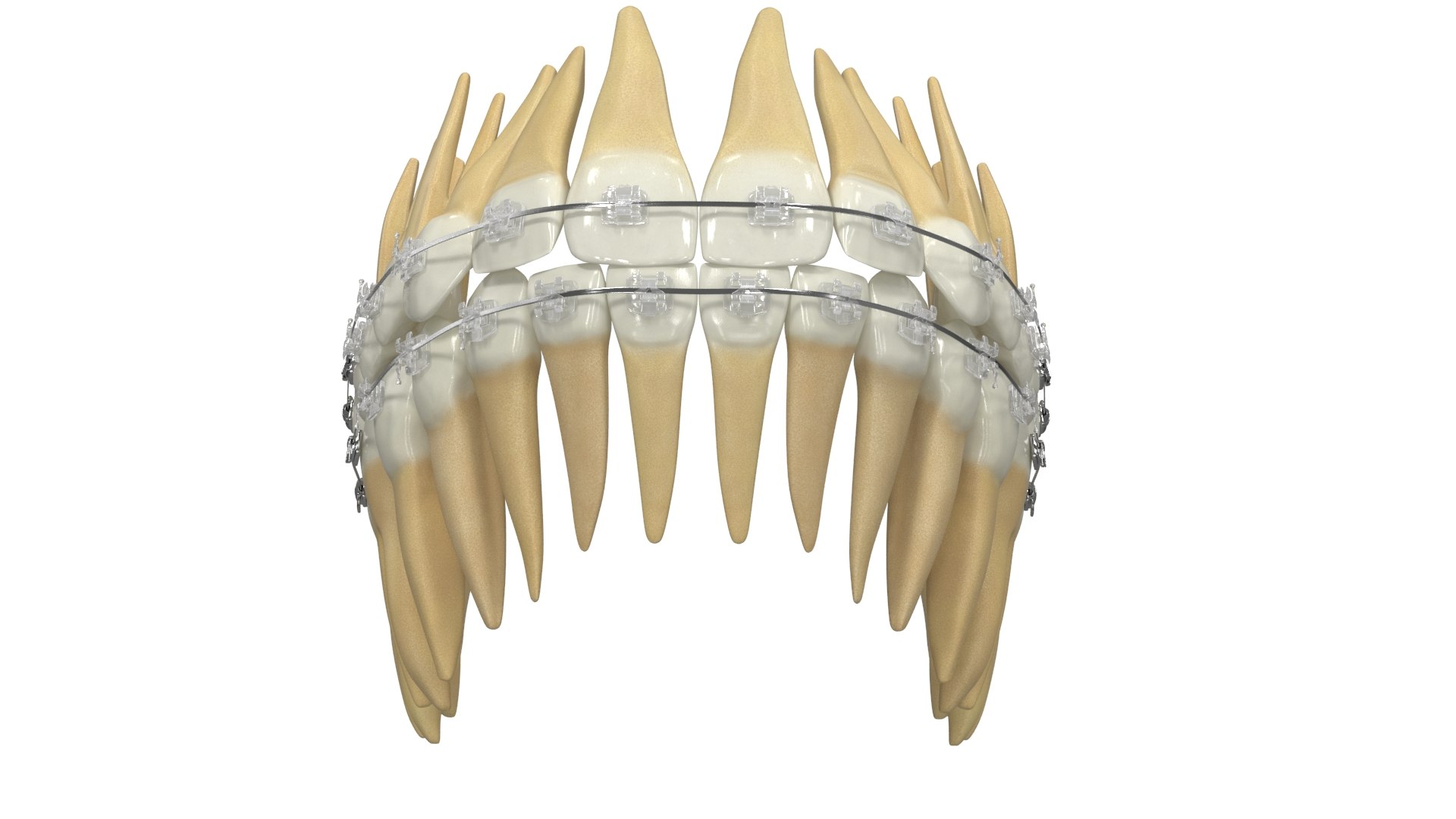 3D Human Teeth With Self Ligating Transparent Dental Braces V01 model ...