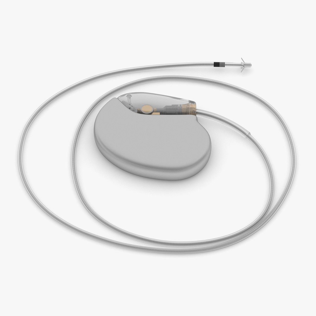 Pacemaker artificial cardiac 3D - TurboSquid 1632716