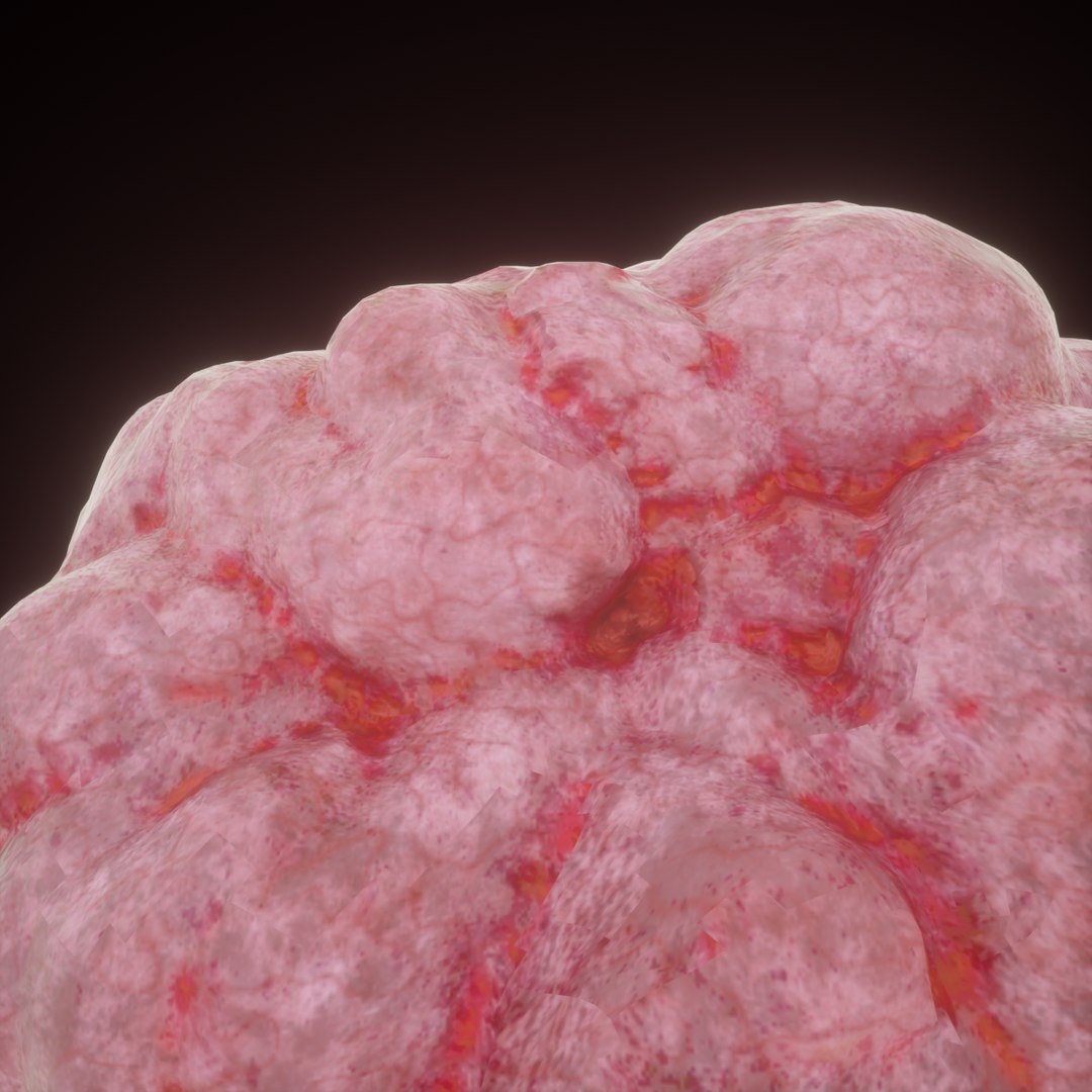 3D Cancer Cell Model - TurboSquid 1391292