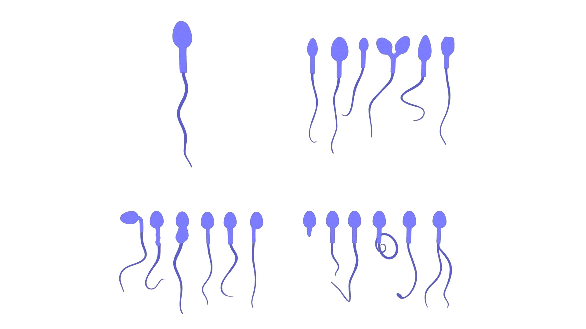 Sperm Morphology Normal and Abnormal 3D - TurboSquid 2132931