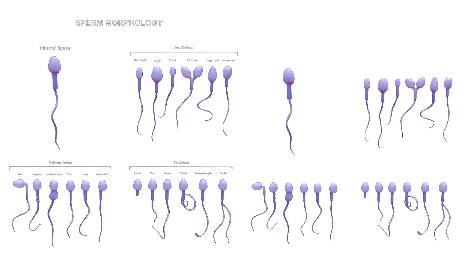 Sperm Morphology Normal and Abnormal 3D - TurboSquid 2132931