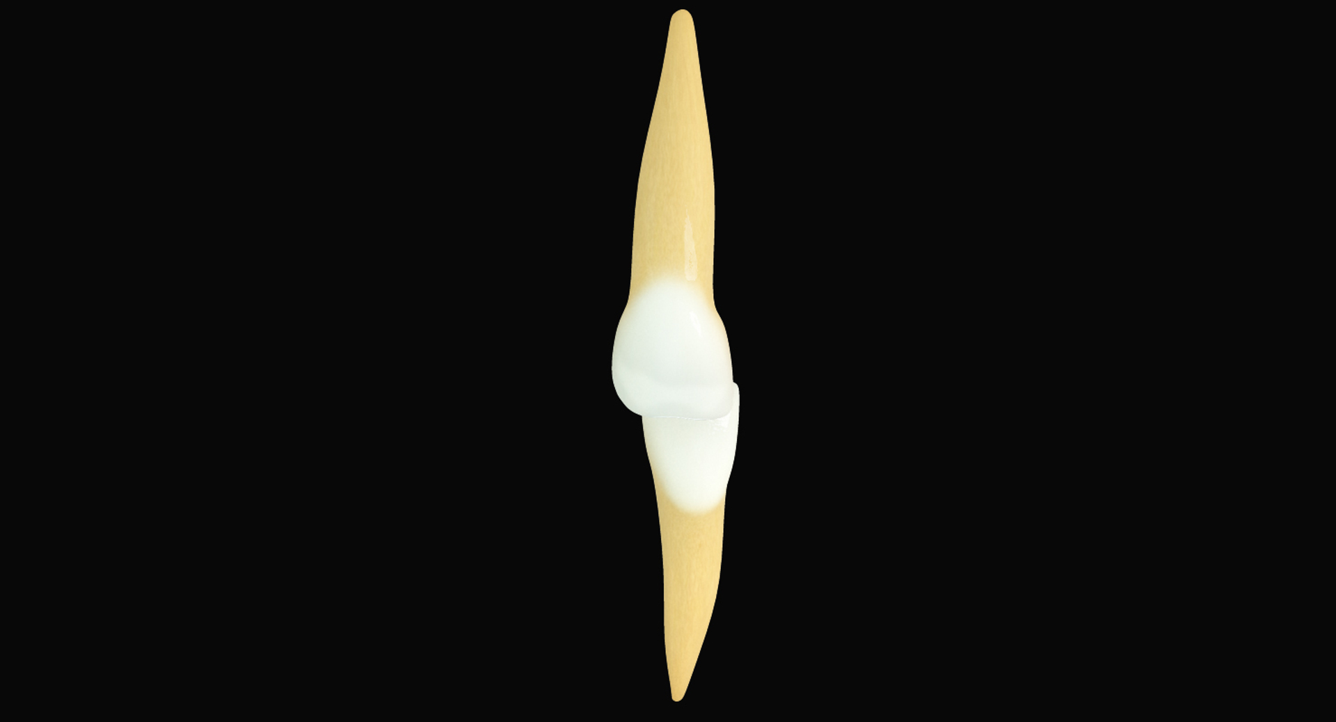 3d Model Primary Lateral Incisors