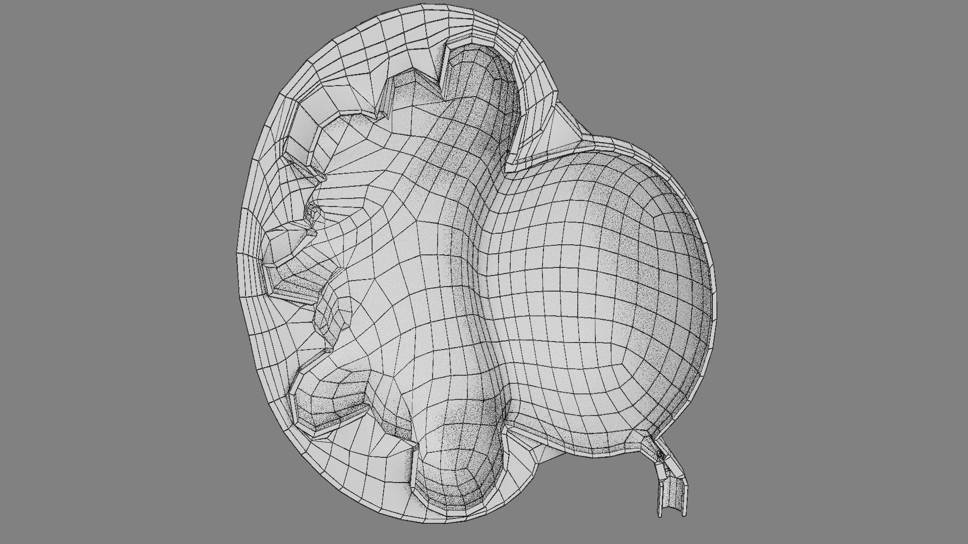 3D Hydronephrosis Marked Kidney Renal Model - TurboSquid 2320712