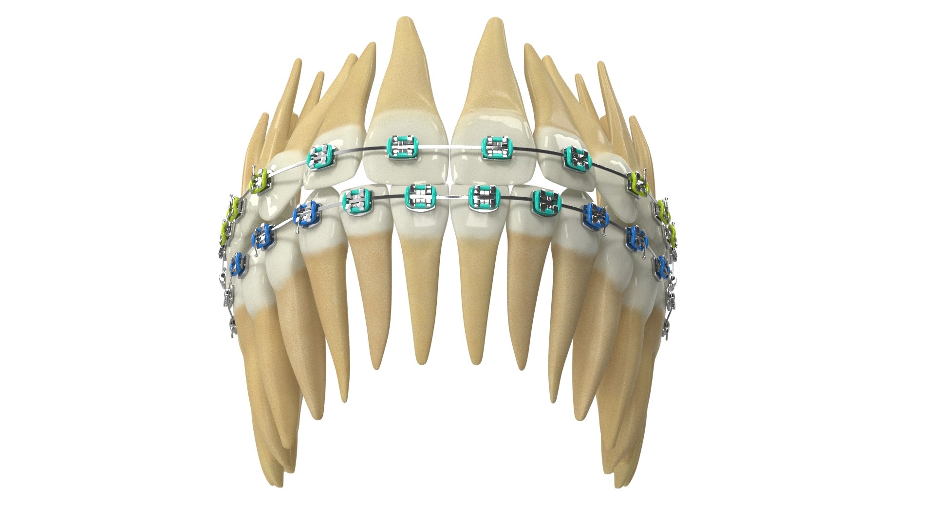 Human Teeth With Steel Dental Braces V04 Model - TurboSquid 2211971