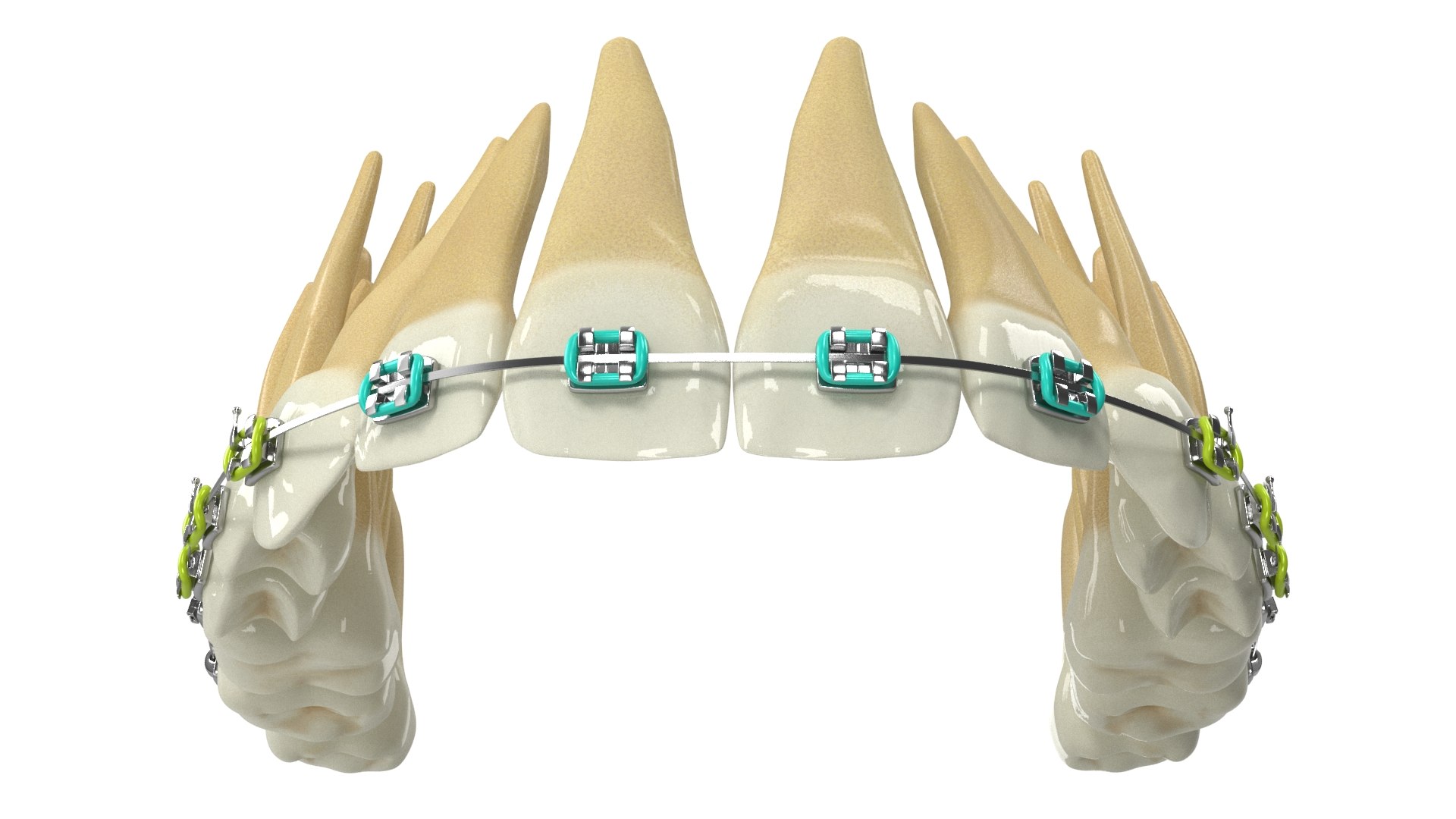 Human Teeth With Steel Dental Braces V04 Model - TurboSquid 2211971