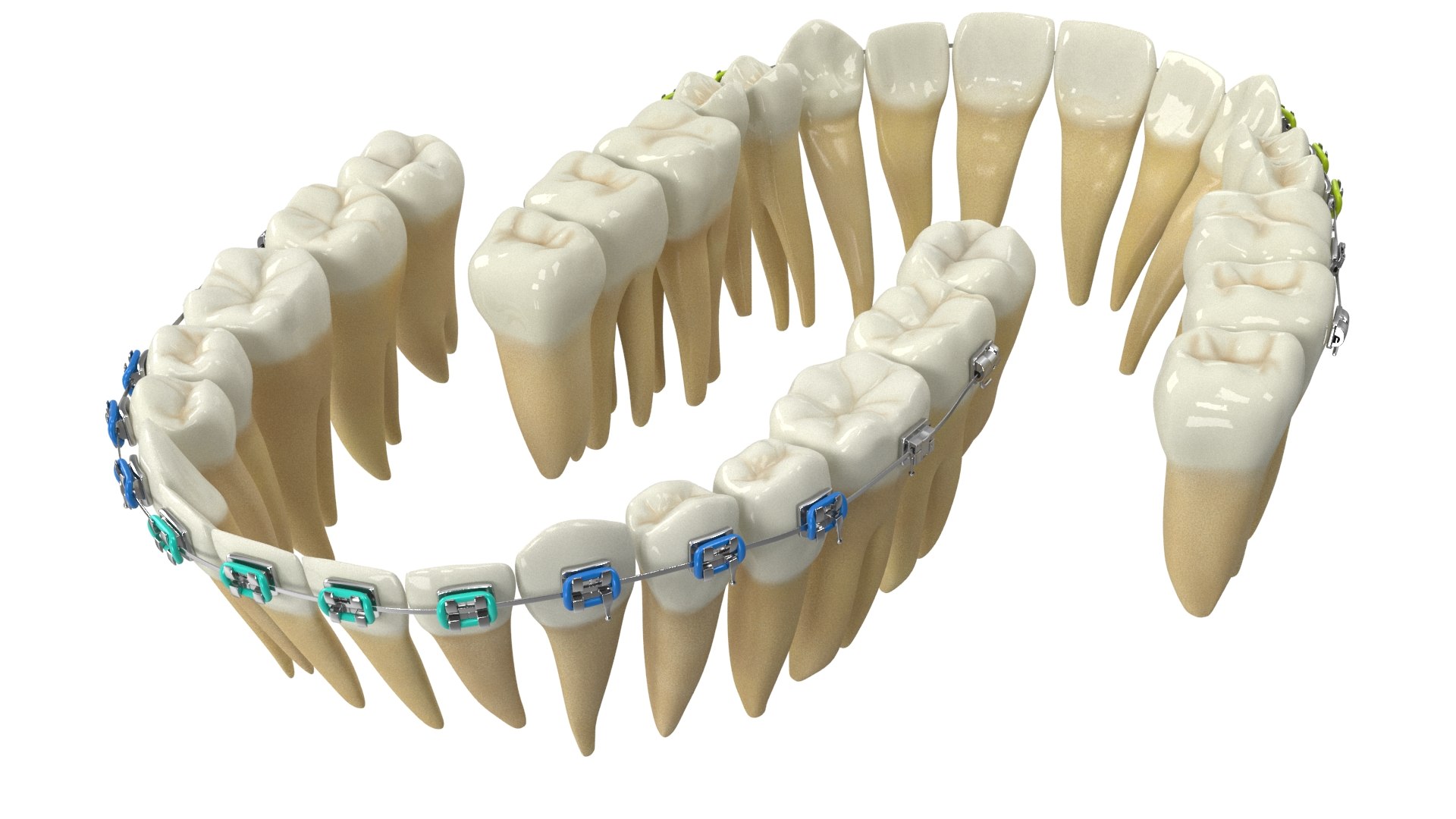 Human Teeth With Steel Dental Braces V04 Model - TurboSquid 2211971