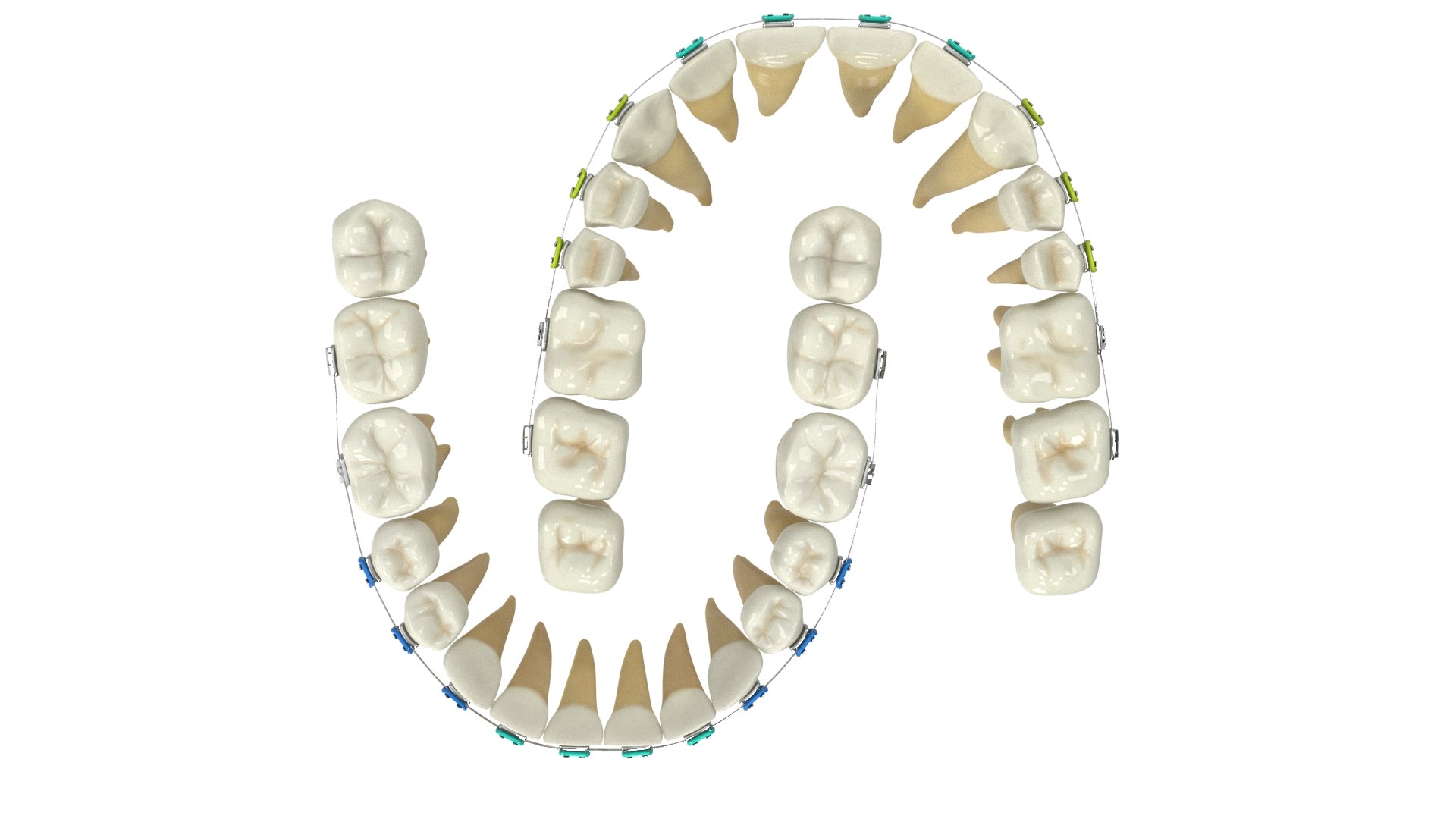 Human Teeth With Steel Dental Braces V04 Model - TurboSquid 2211971