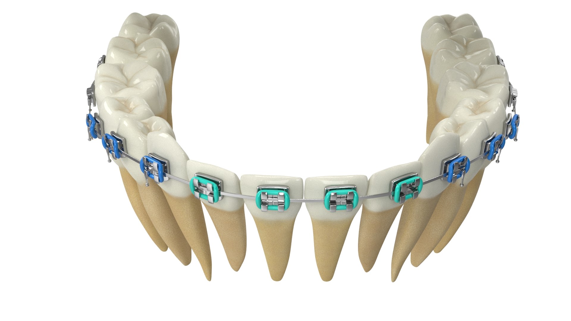 Human Teeth With Steel Dental Braces V04 Model - TurboSquid 2211971
