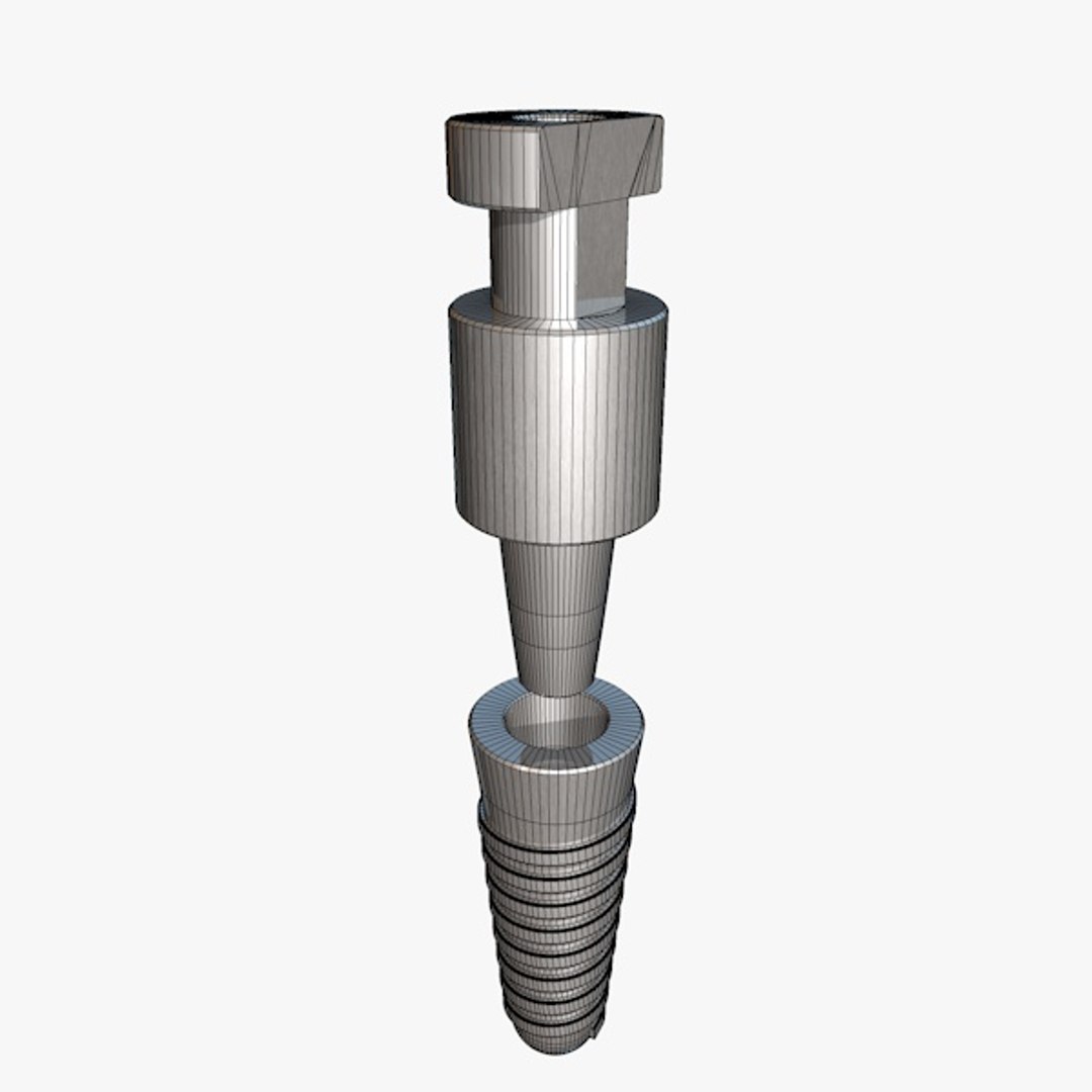 3d model dental implant