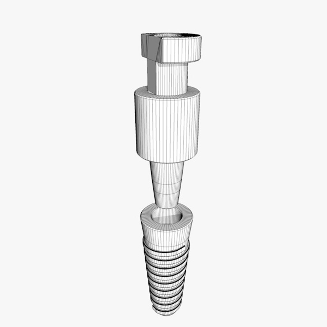 3d model dental implant
