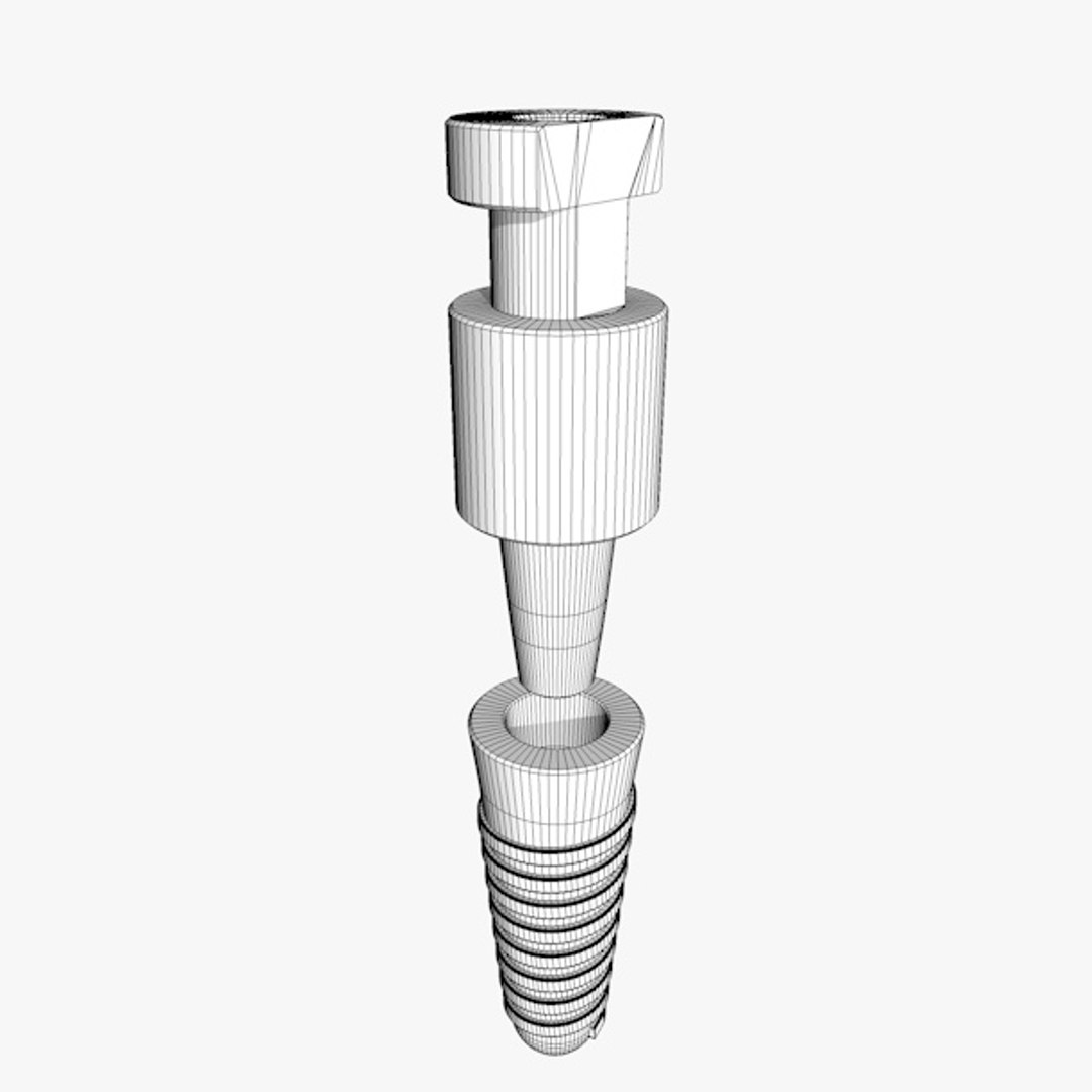 3d model dental implant