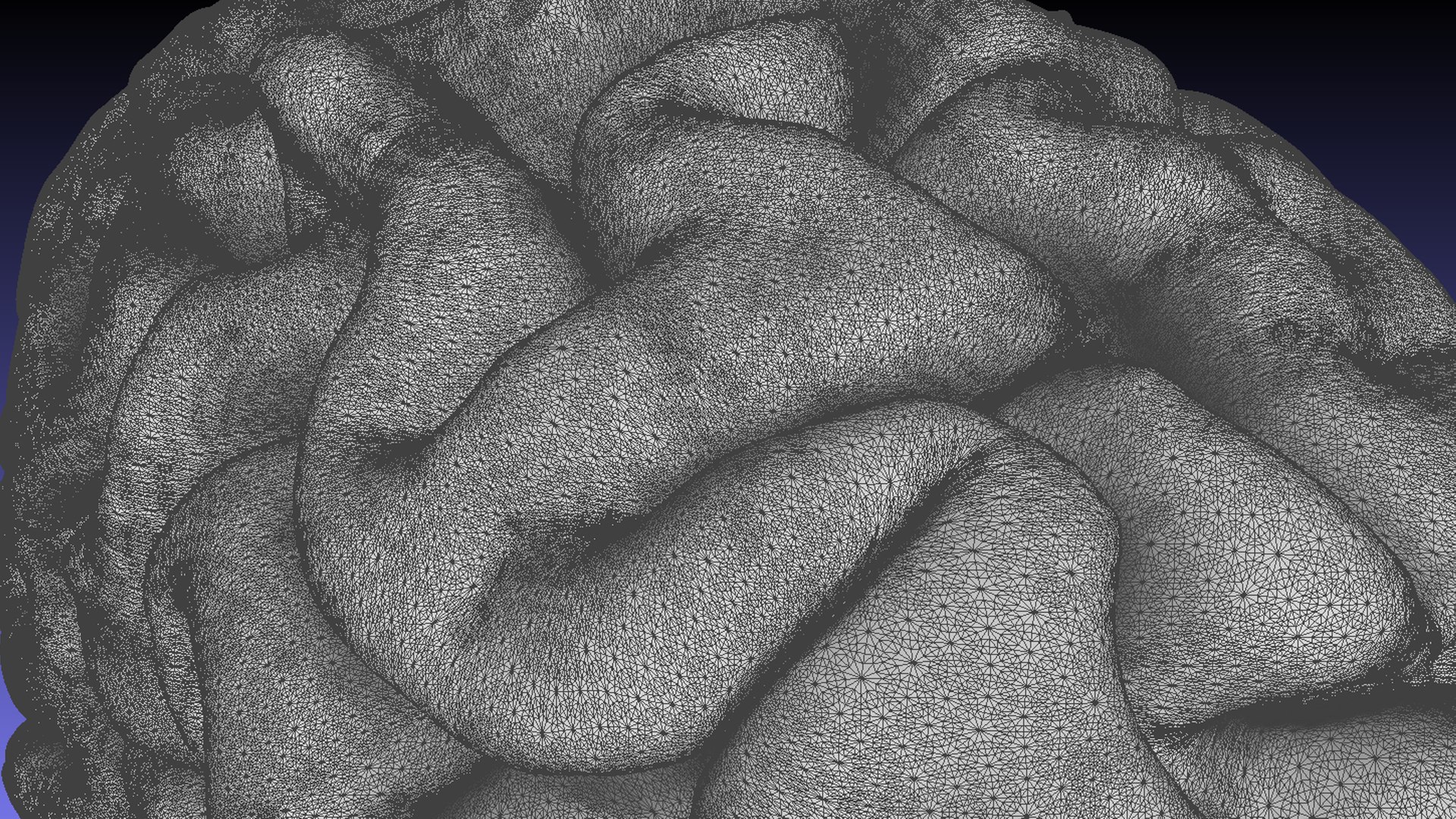 Human Brain From MRI Scan High Resolution 3D - TurboSquid 1849260