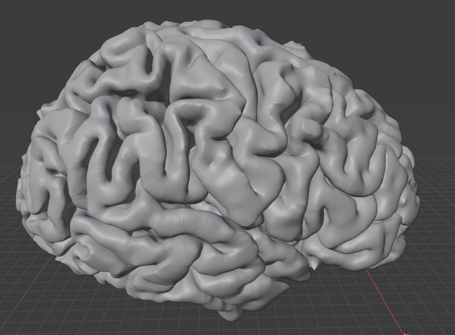 Brain Mri Scan 3d