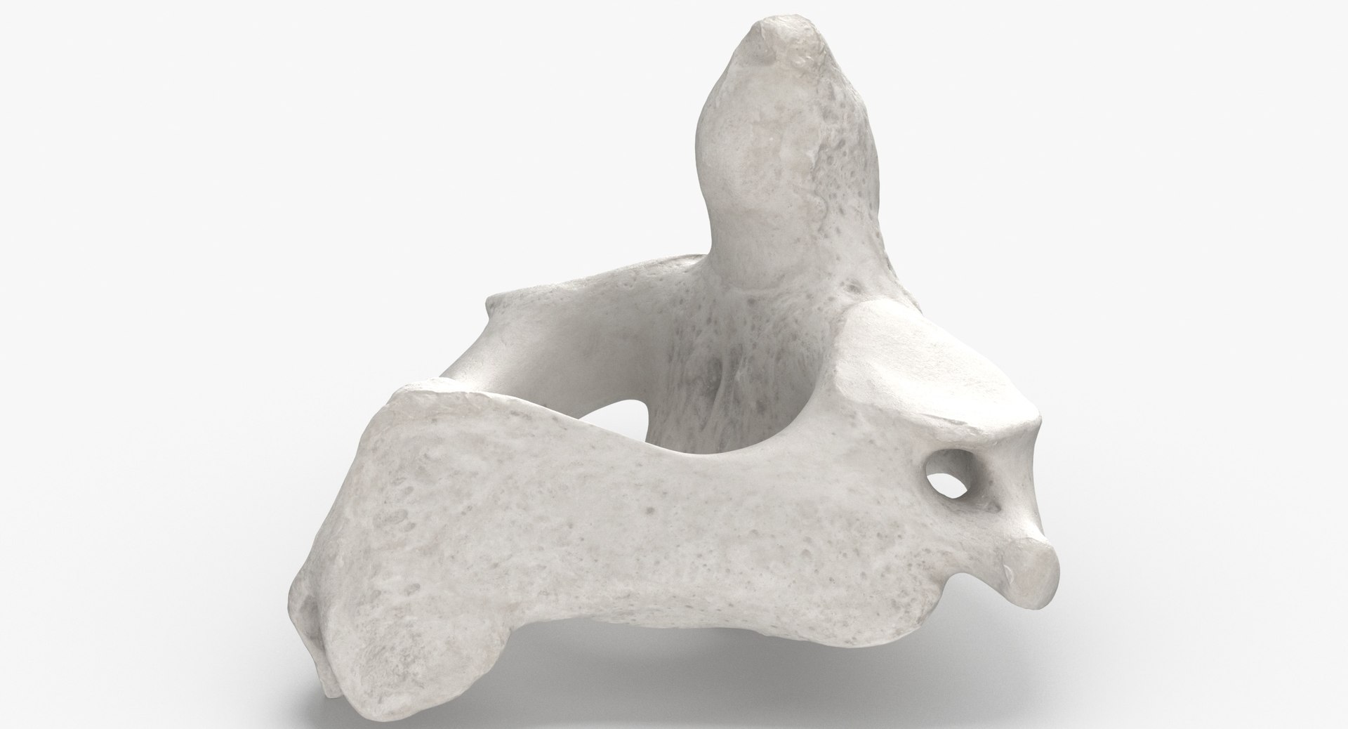 Cervical Vertebrae C2 Axis 3D Model - TurboSquid 1574022