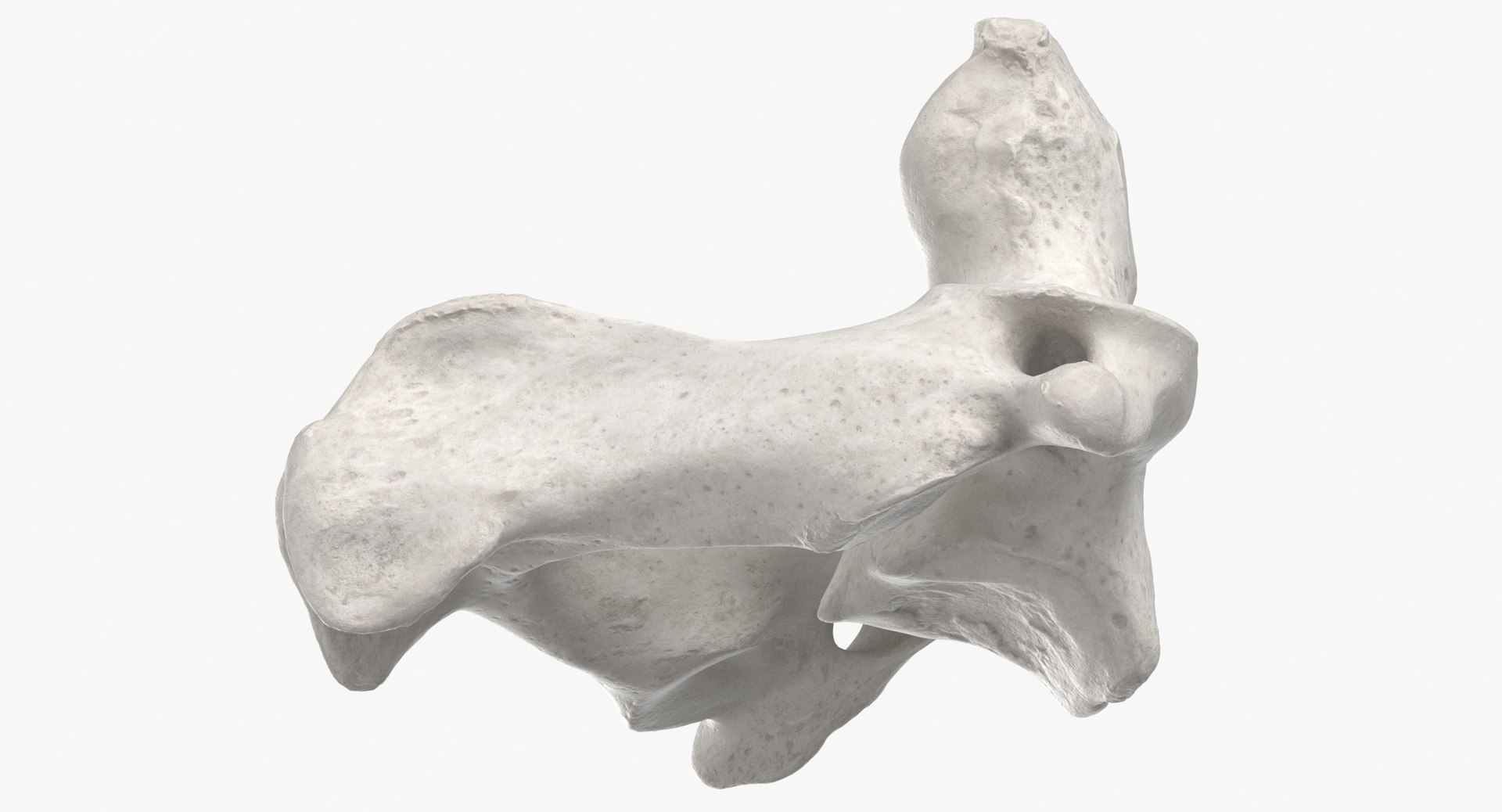 Cervical Vertebrae C2 Axis 3D Model - TurboSquid 1574022