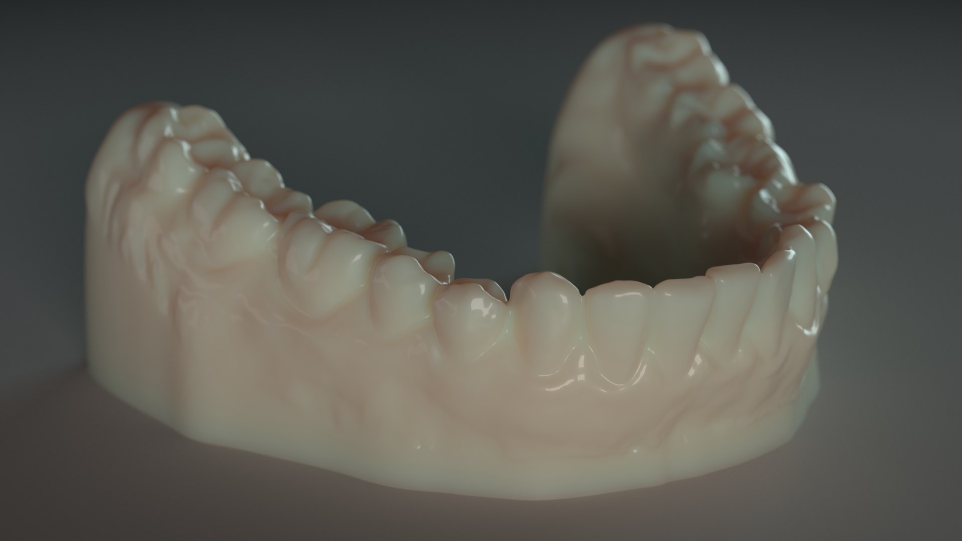 3D Denture Mold Model - TurboSquid 1677033
