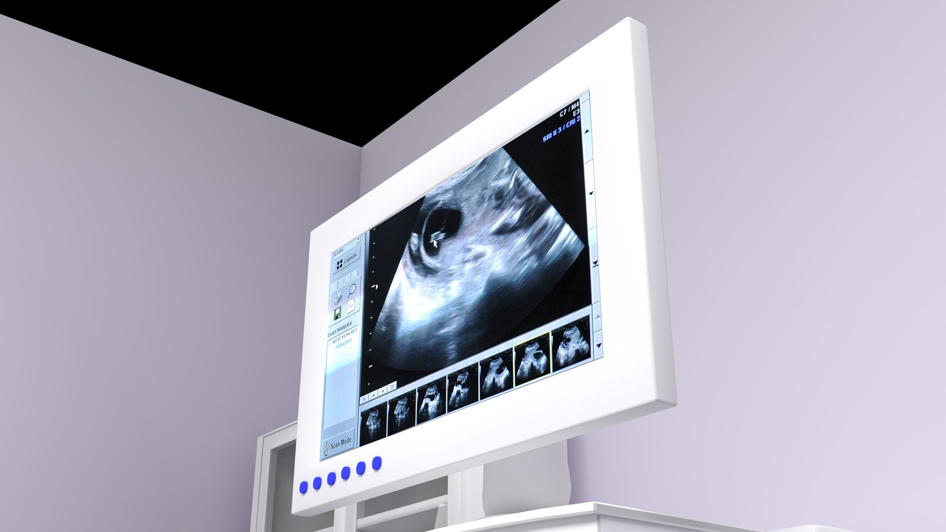 3D Model Ultrasound Room 3 - TurboSquid 2059534