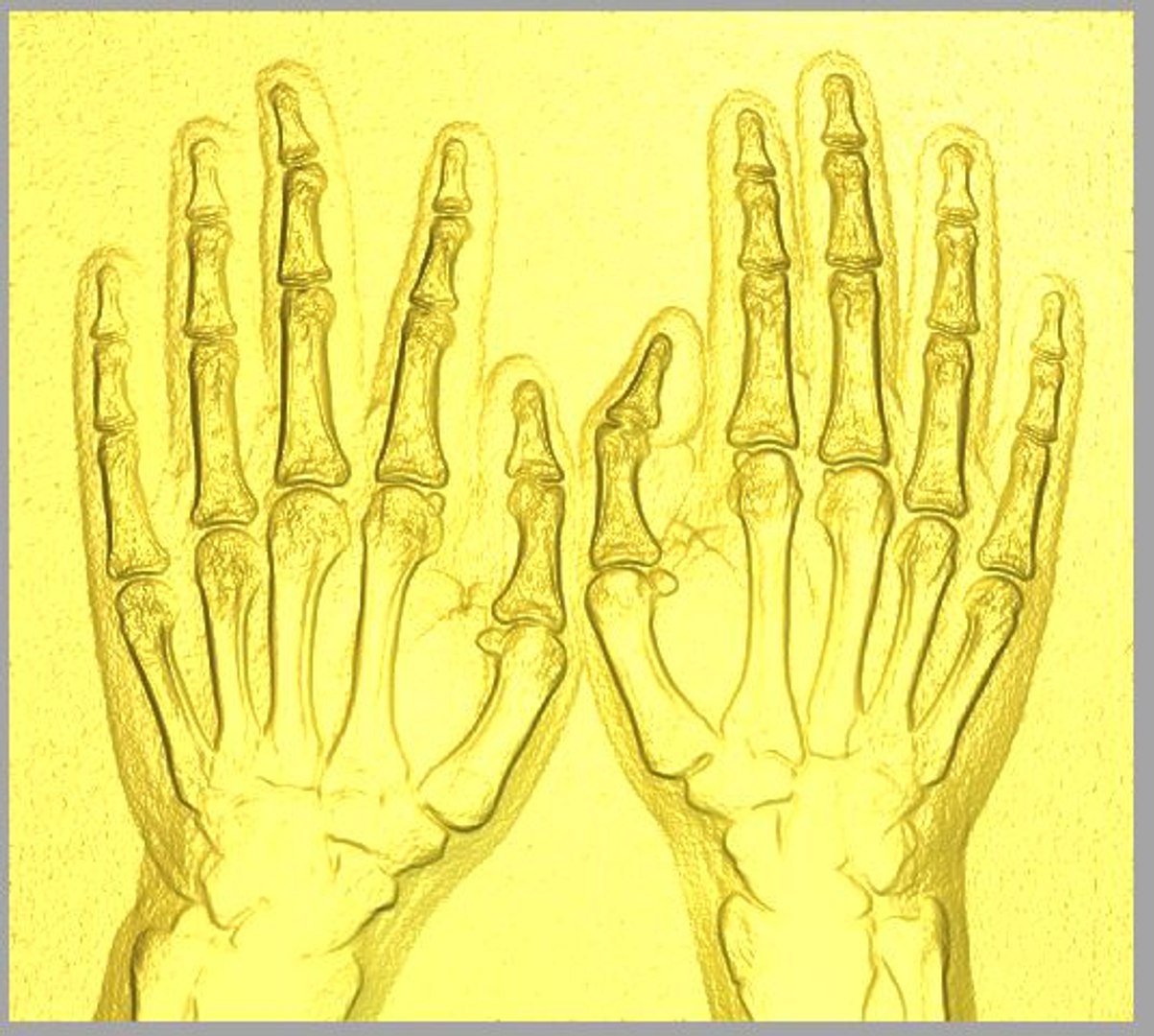 Xray Hand Human Bones 3D - TurboSquid 1278530