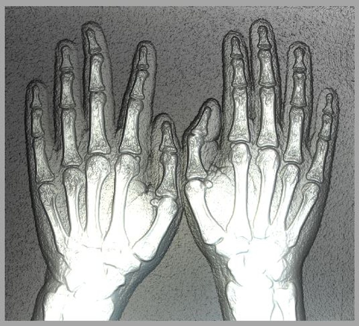 Xray Hand Human Bones 3D - TurboSquid 1278530