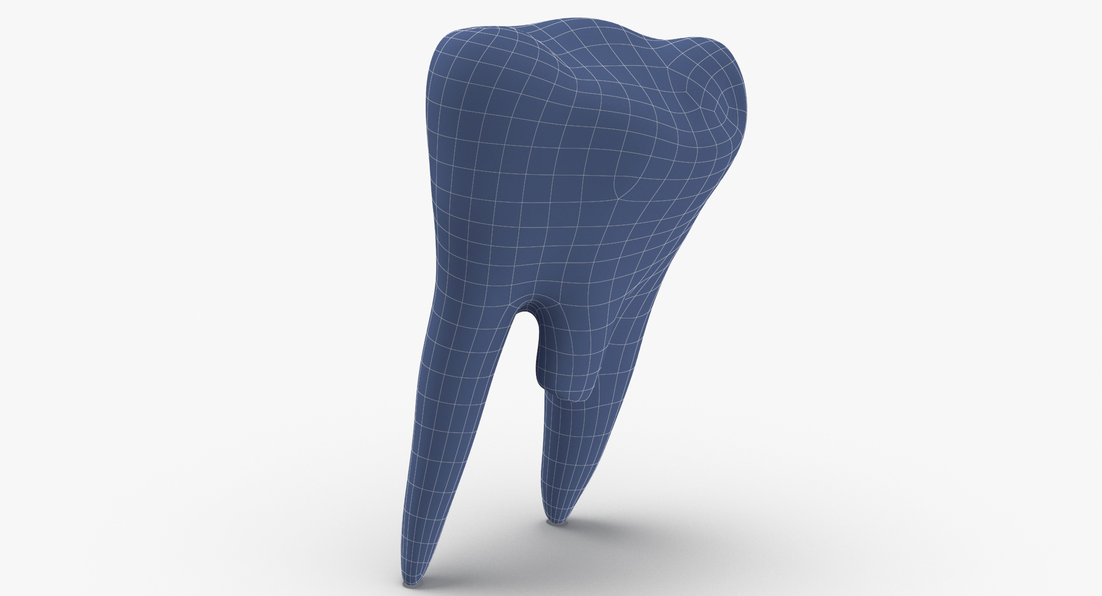 Human Teeth with Cavity Collection - 3 models 3D model - TurboSquid 1753818