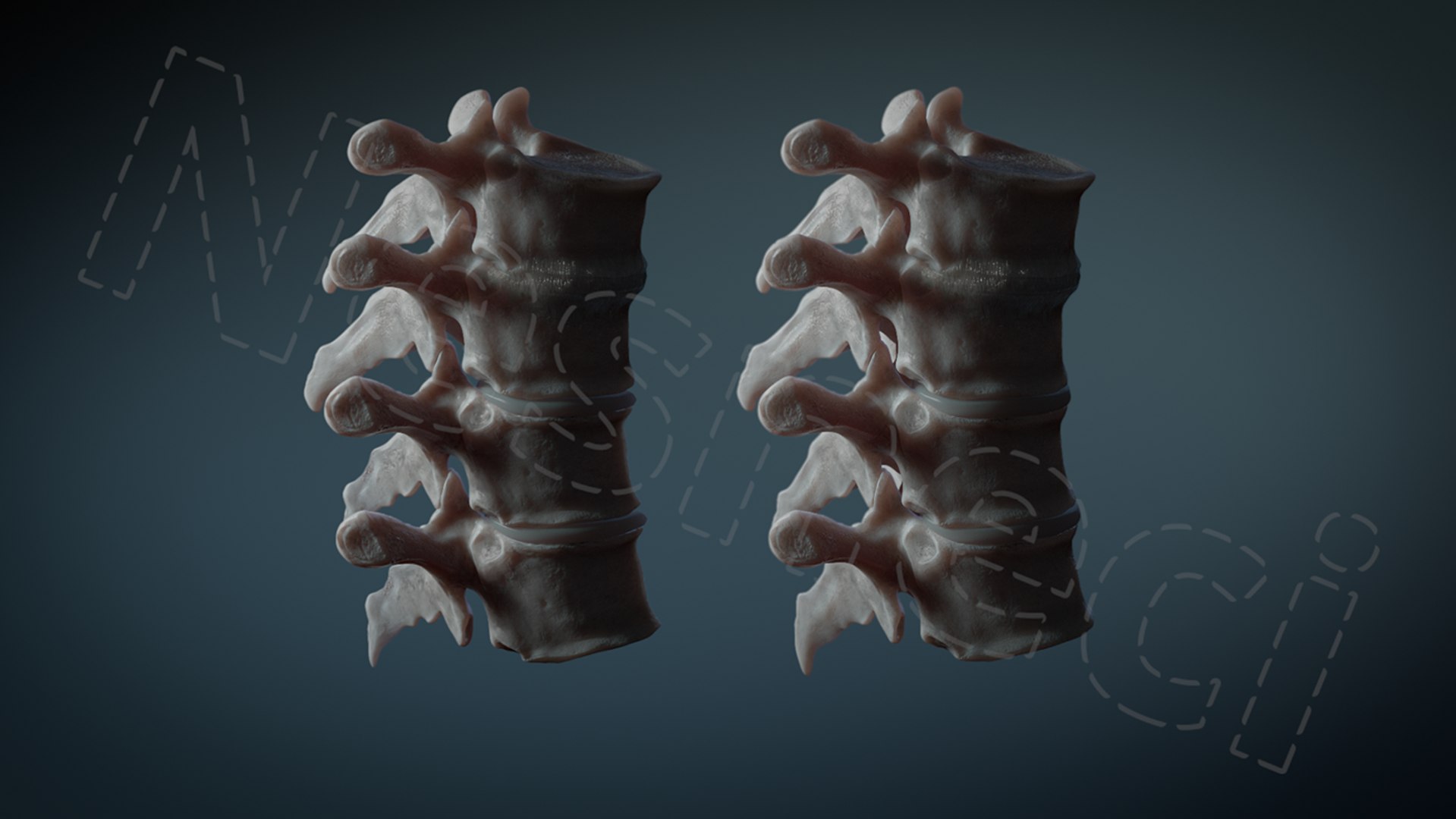 3D Human Vertebrae T6 Cross Section - TurboSquid 1239928