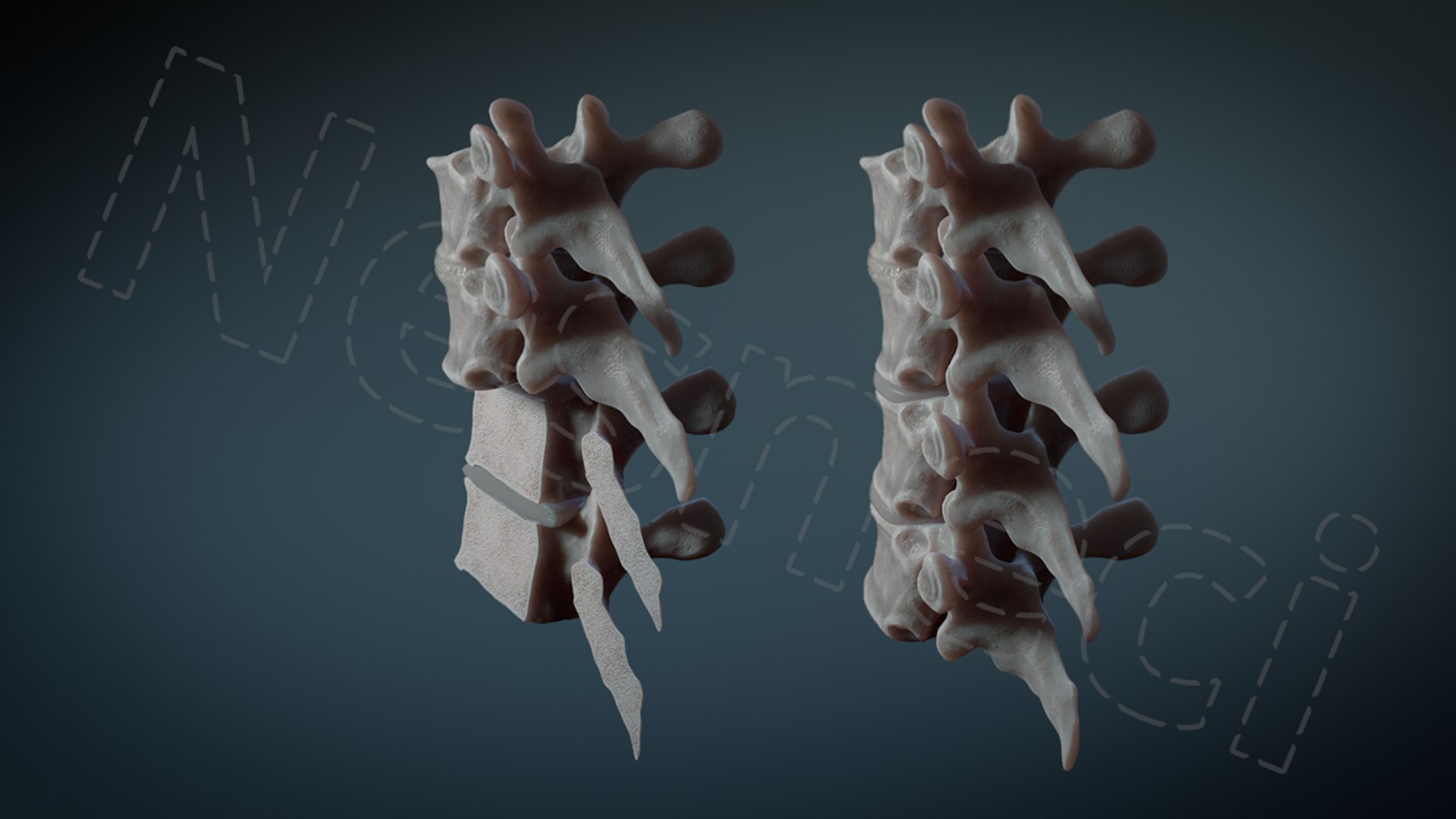 3D Human Vertebrae T6 Cross Section - TurboSquid 1239928