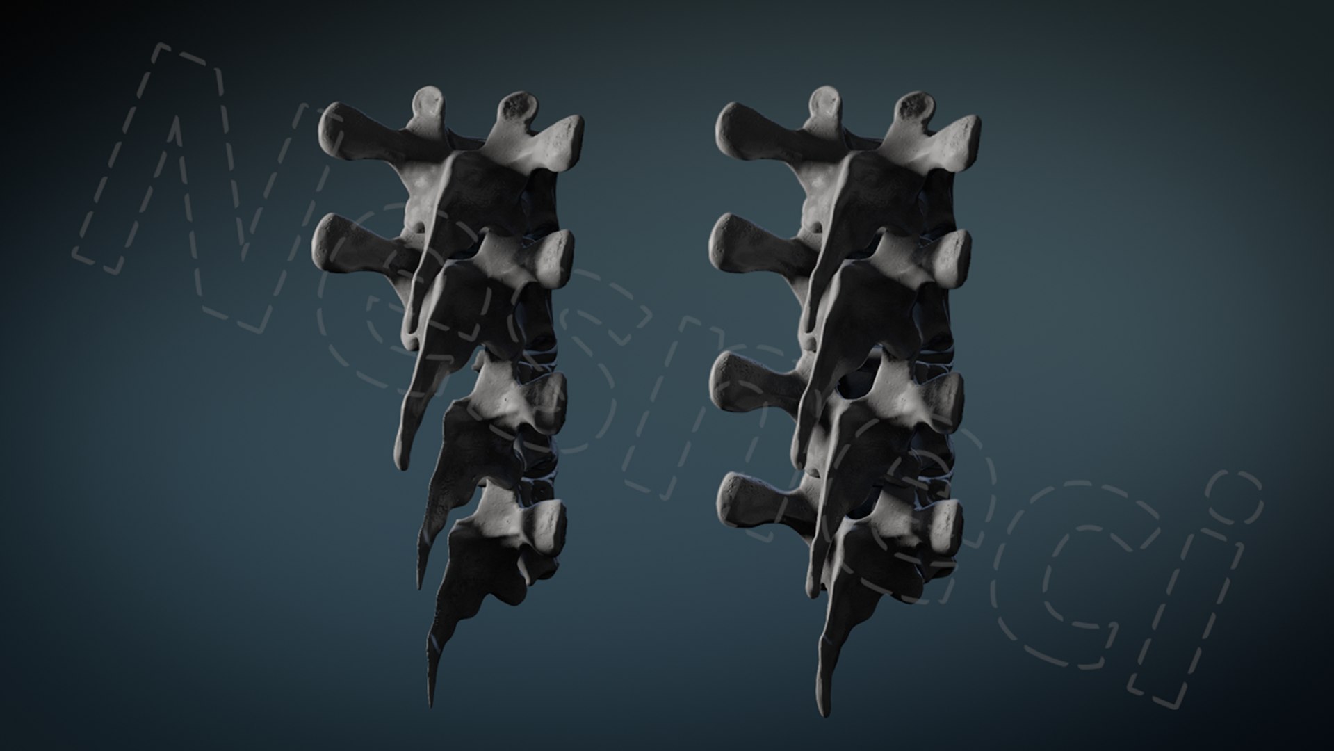 3D Human Vertebrae T6 Cross Section - TurboSquid 1239928