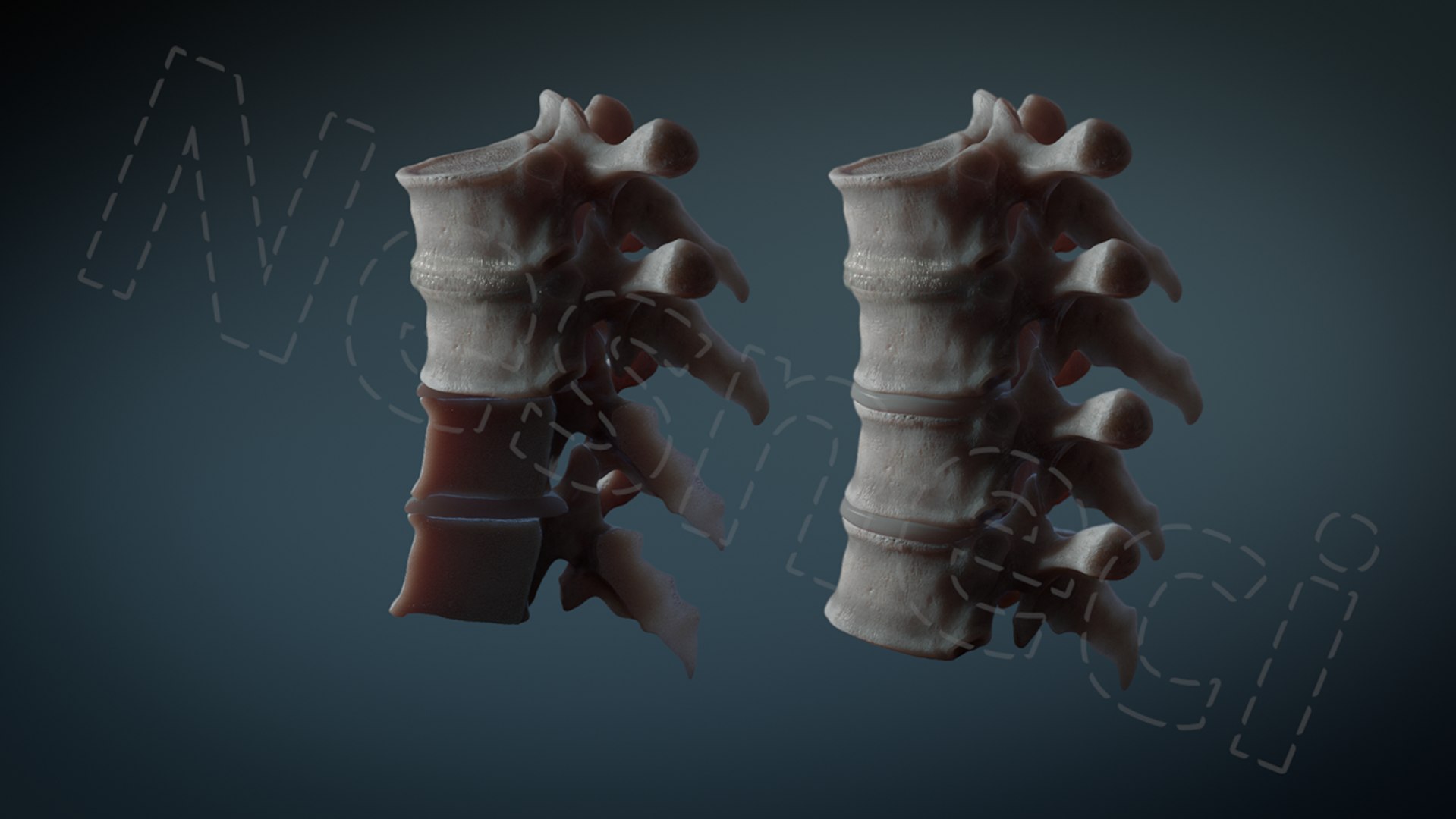 3D Human Vertebrae T6 Cross Section - TurboSquid 1239928