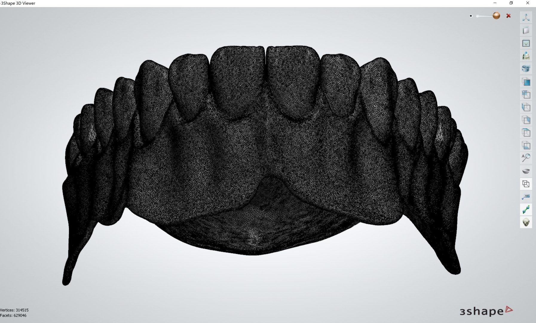 Free Full Denture Set - Upper And Lower Anatomy STL 3D Model ...