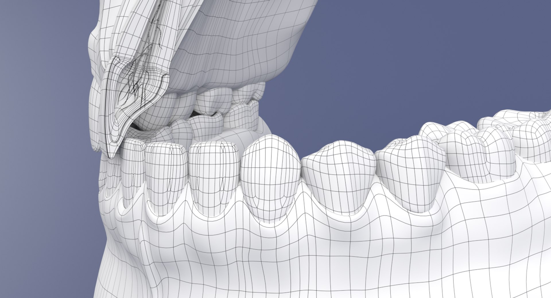 Incisor Section - Model - TurboSquid 1404732