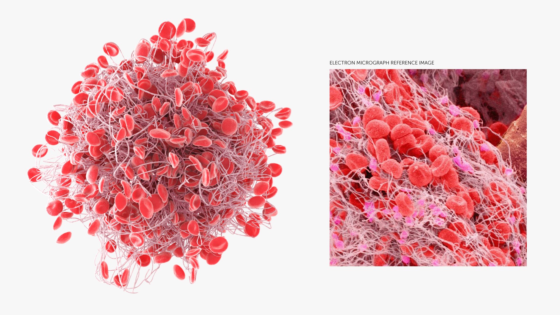 3D Blood Clot Model - TurboSquid 1948928