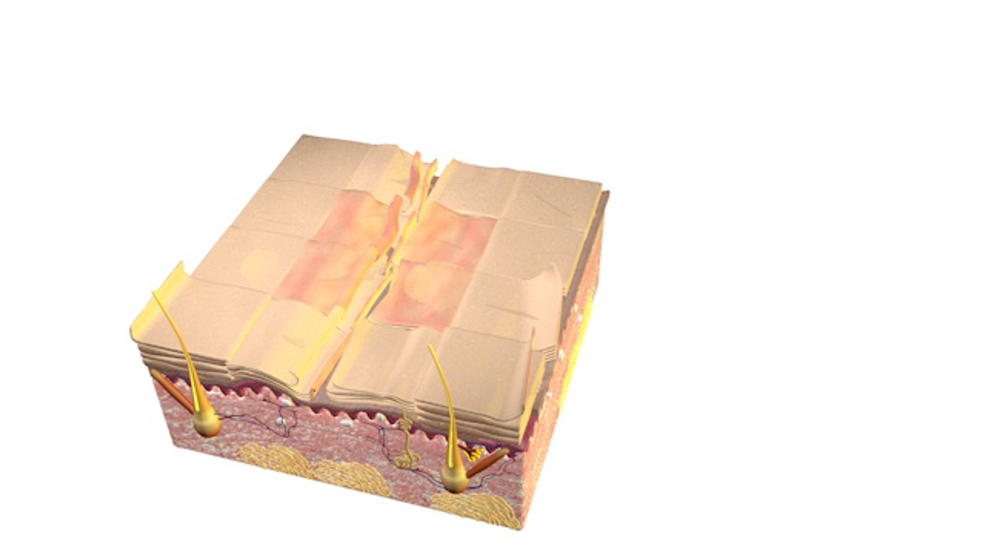 3d model of skin damage