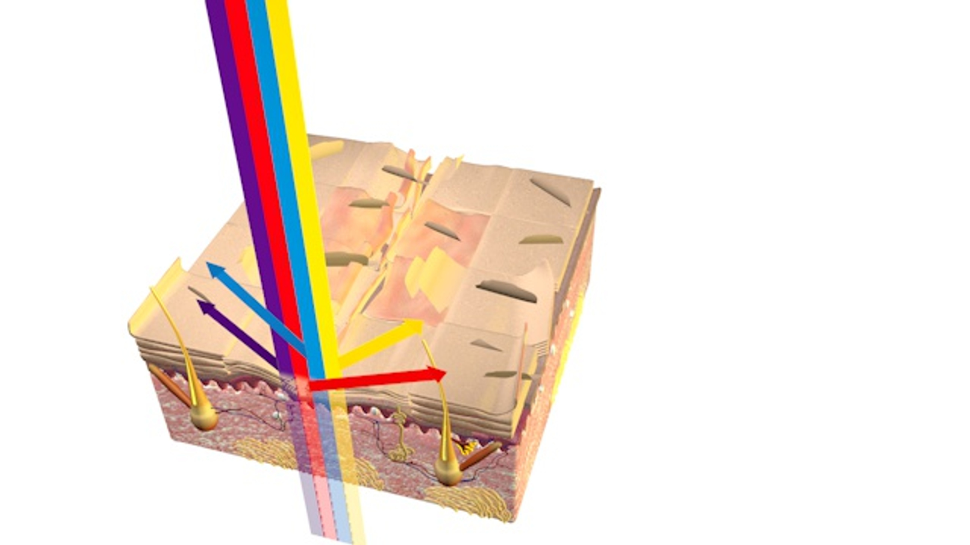 3d model of skin damage