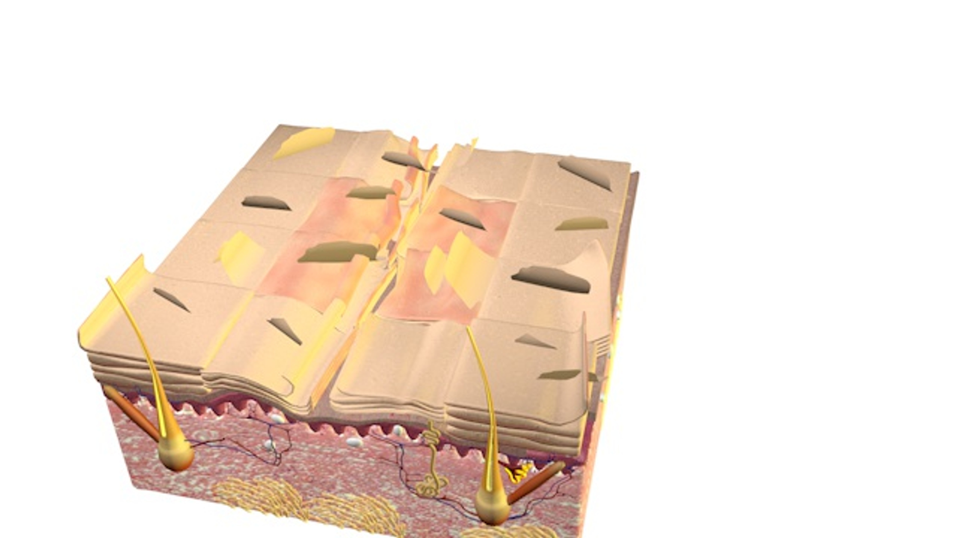 3d model of skin damage