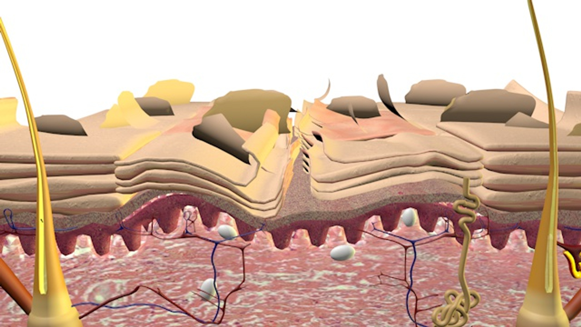 3d model of skin damage