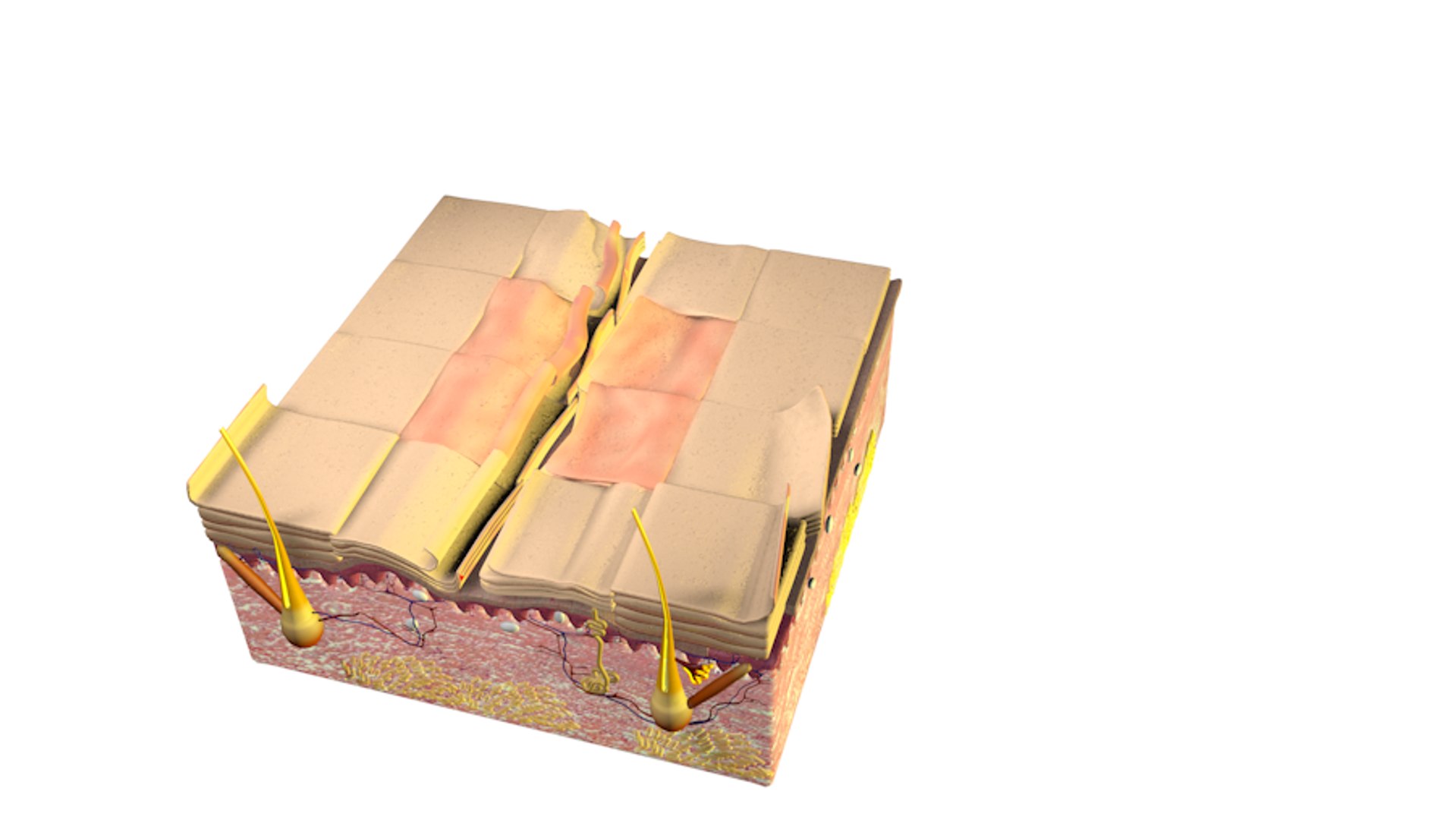 3d model of skin damage