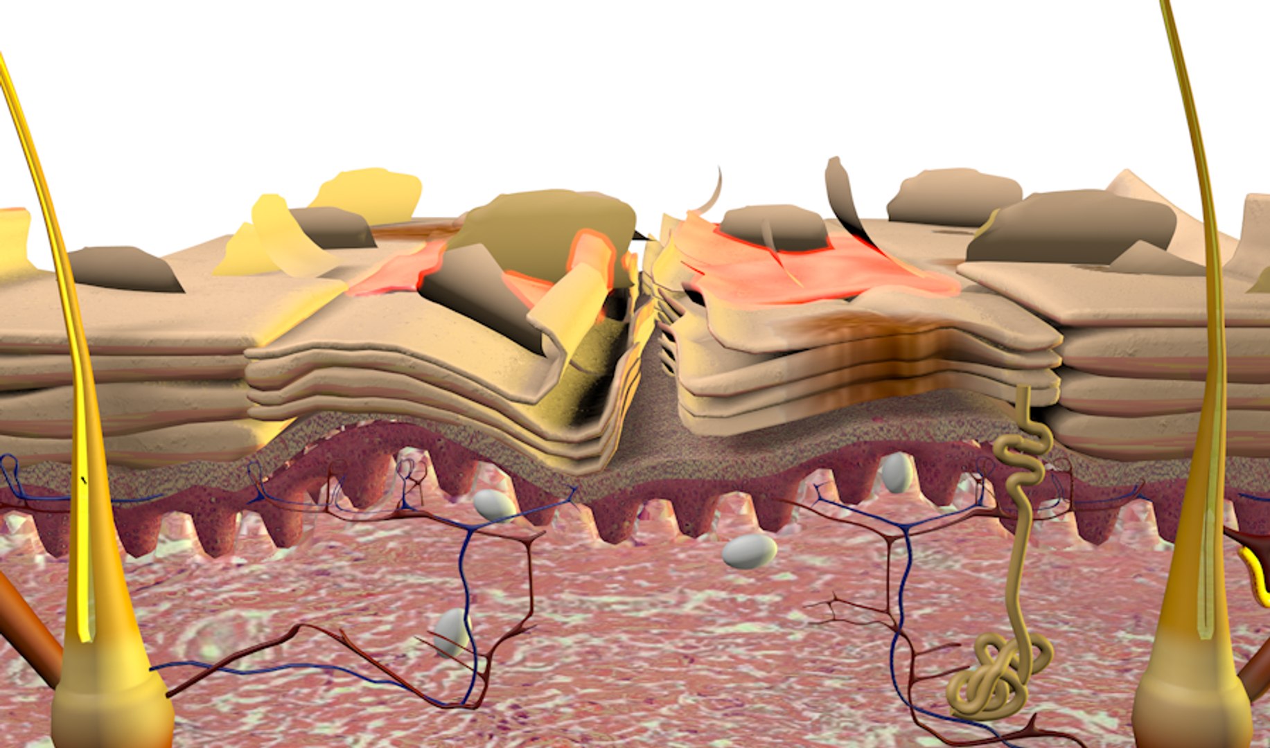 3d model of skin damage